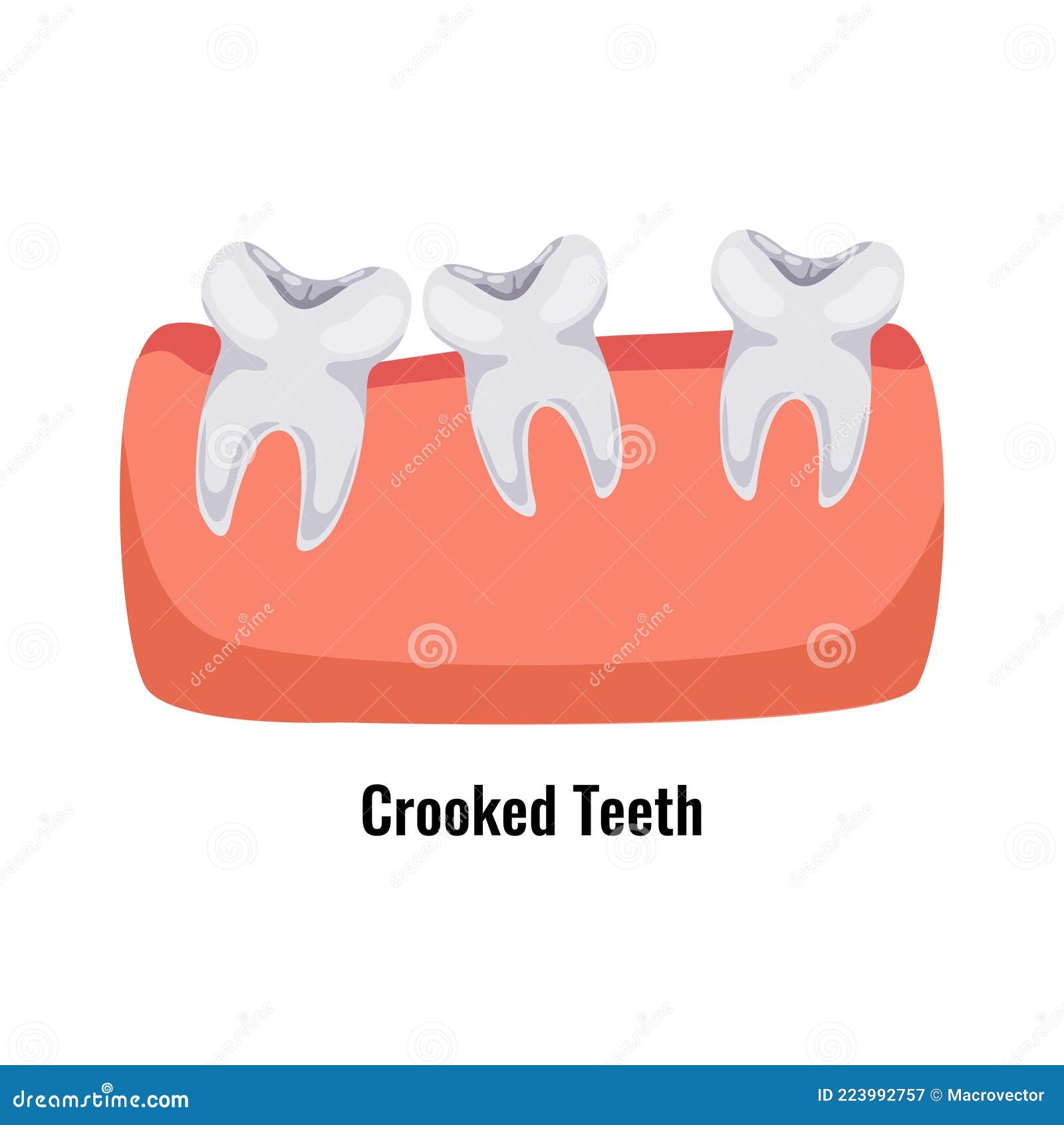 Dental Problem Poster stock vector. Illustration of white - 223992757