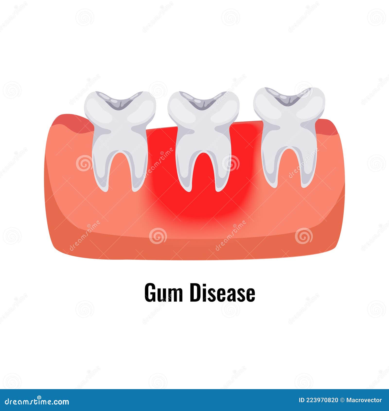 Dental Problem Poster stock vector. Illustration of enamel - 223970820