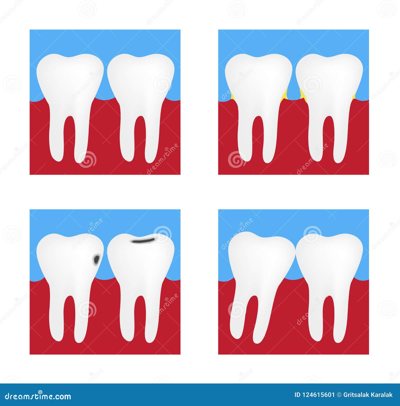 Dental Problems And Tooth Diseases Infographic Cartoon Vector ...