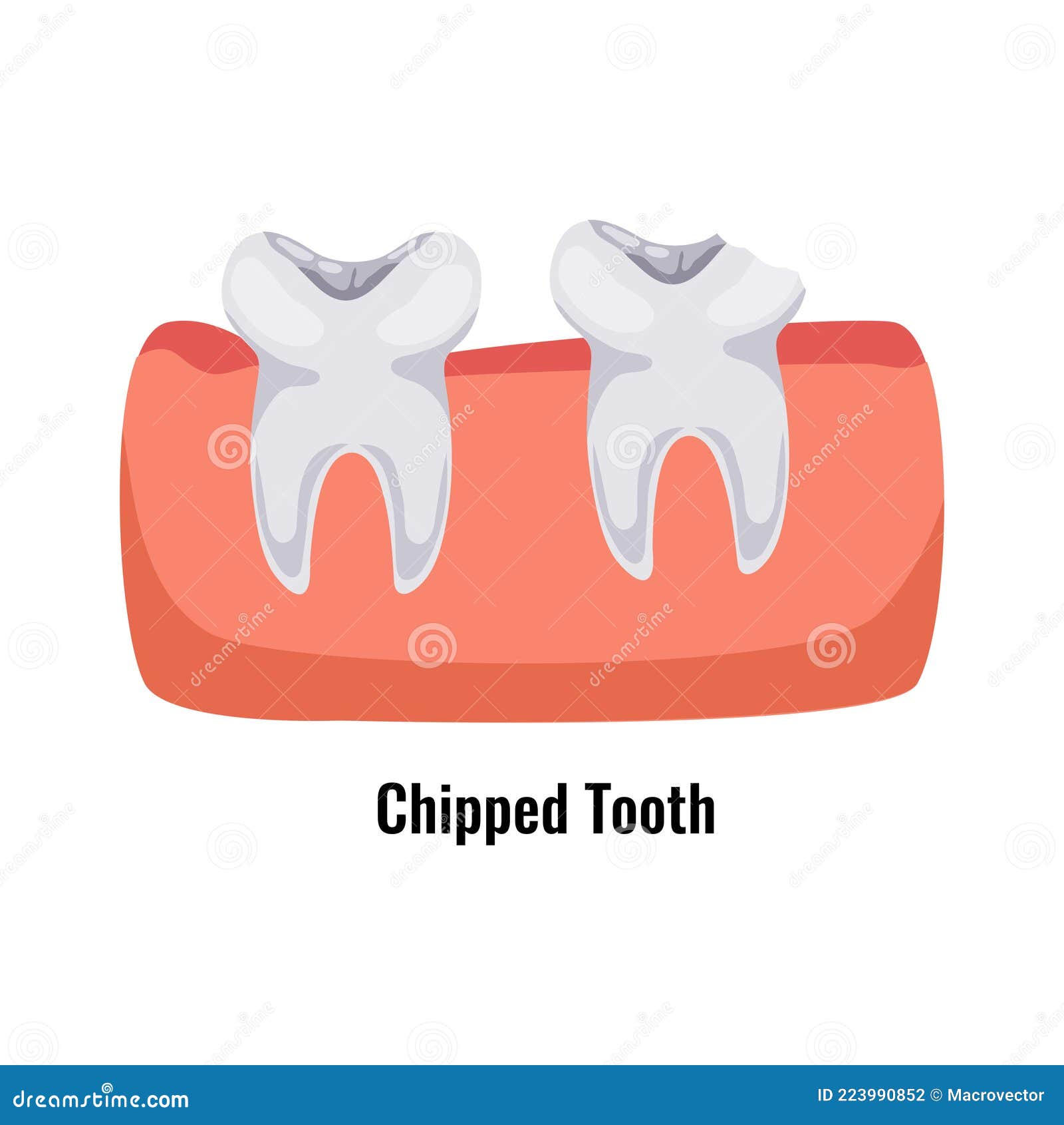 Dental Problems Poster stock vector. Illustration of white - 223990852