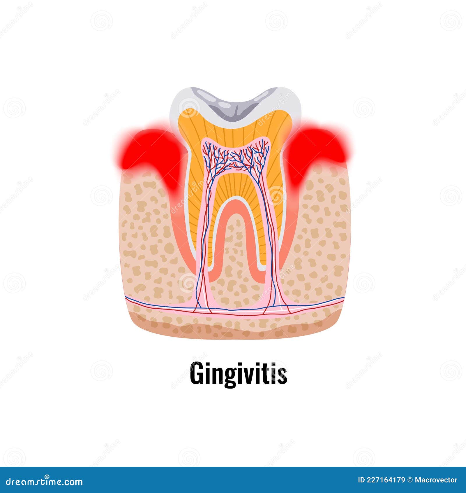 Dental Problems Poster stock vector. Illustration of icon - 227164179