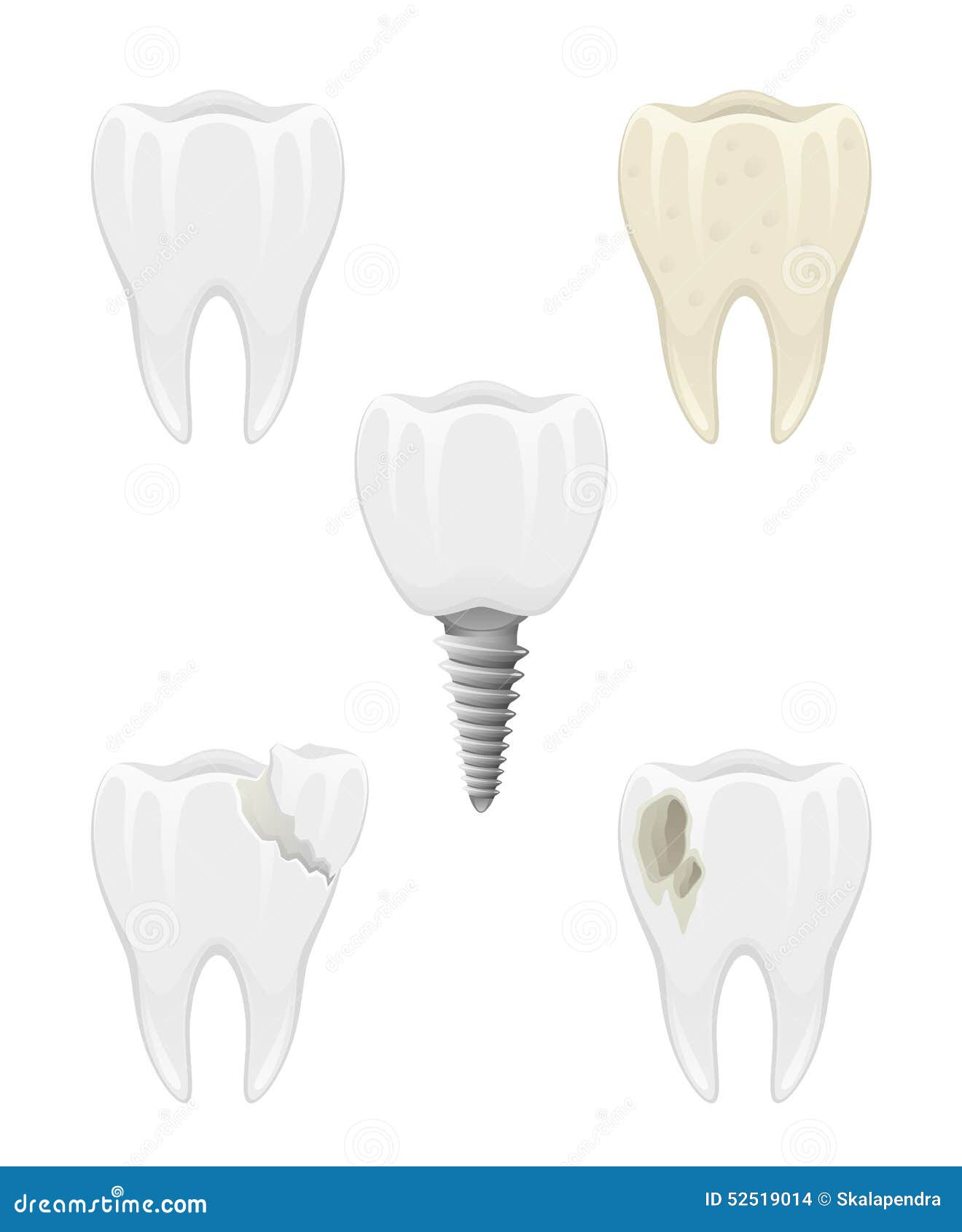 Dental problems stock vector. Illustration of dent, metal - 52519014