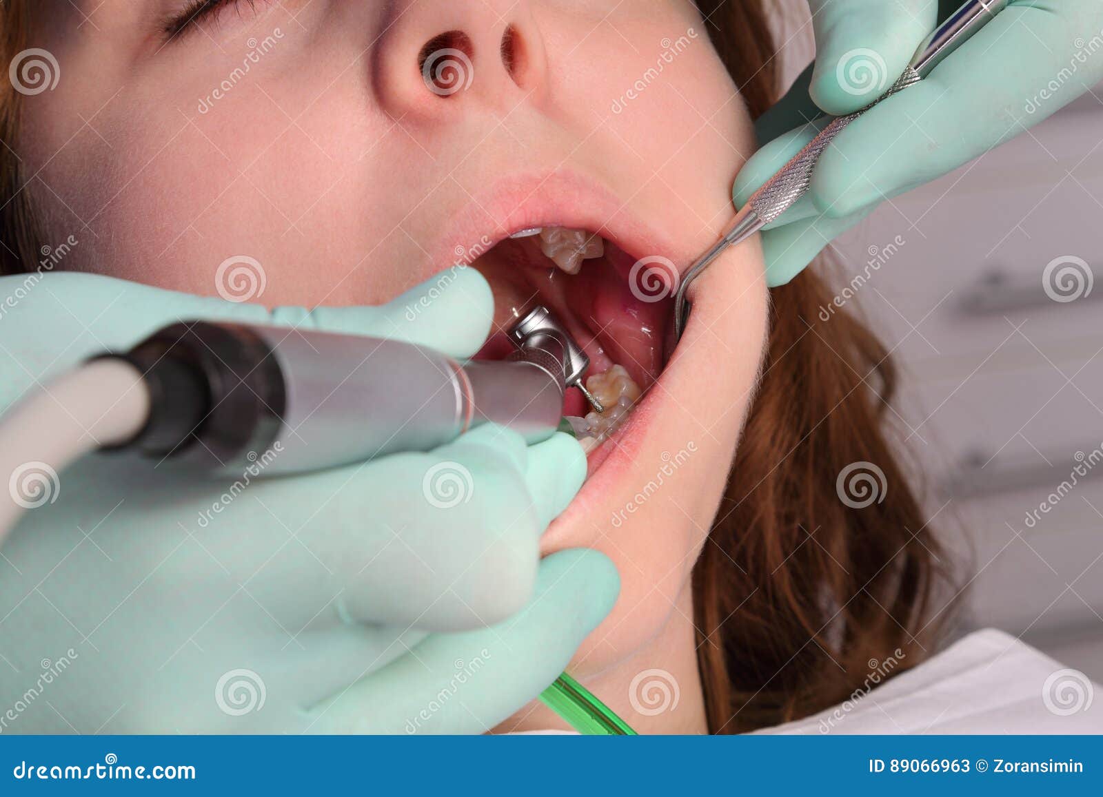 Dental Procedure, Drilling Tooth Stock Image - Image of health, medical ...