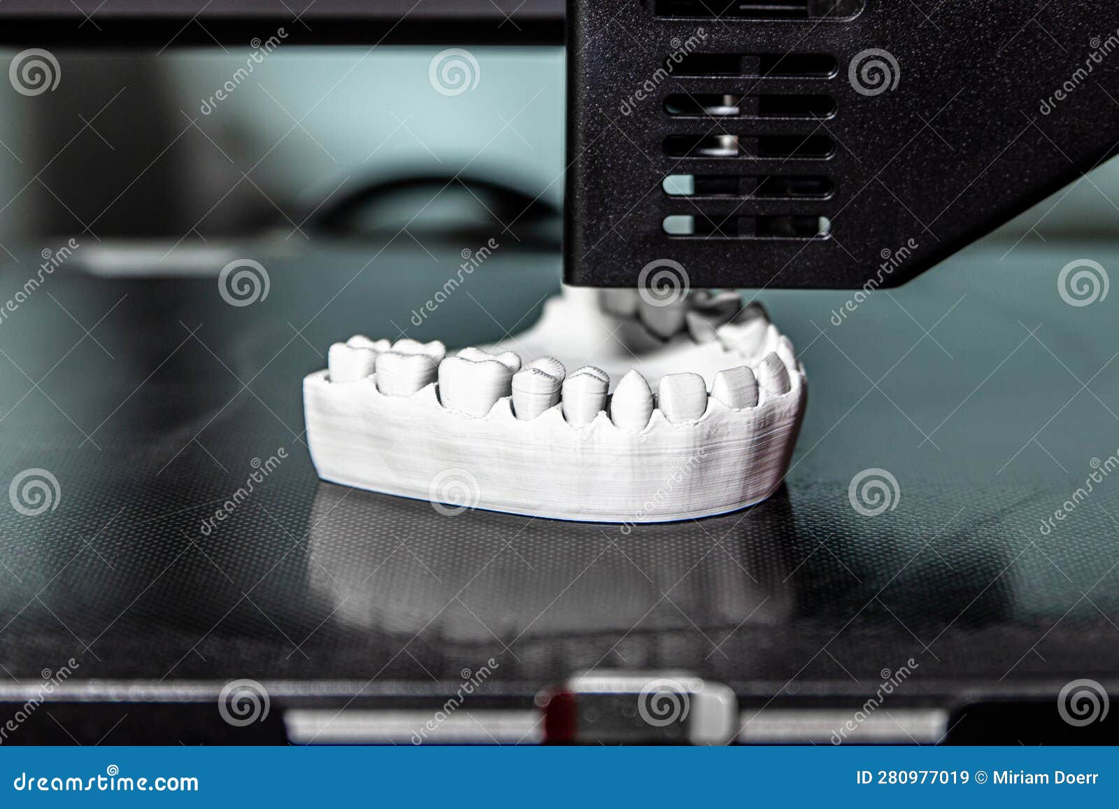 Dental Prostheses from the 3d Printer Stock Image - Image of object ...