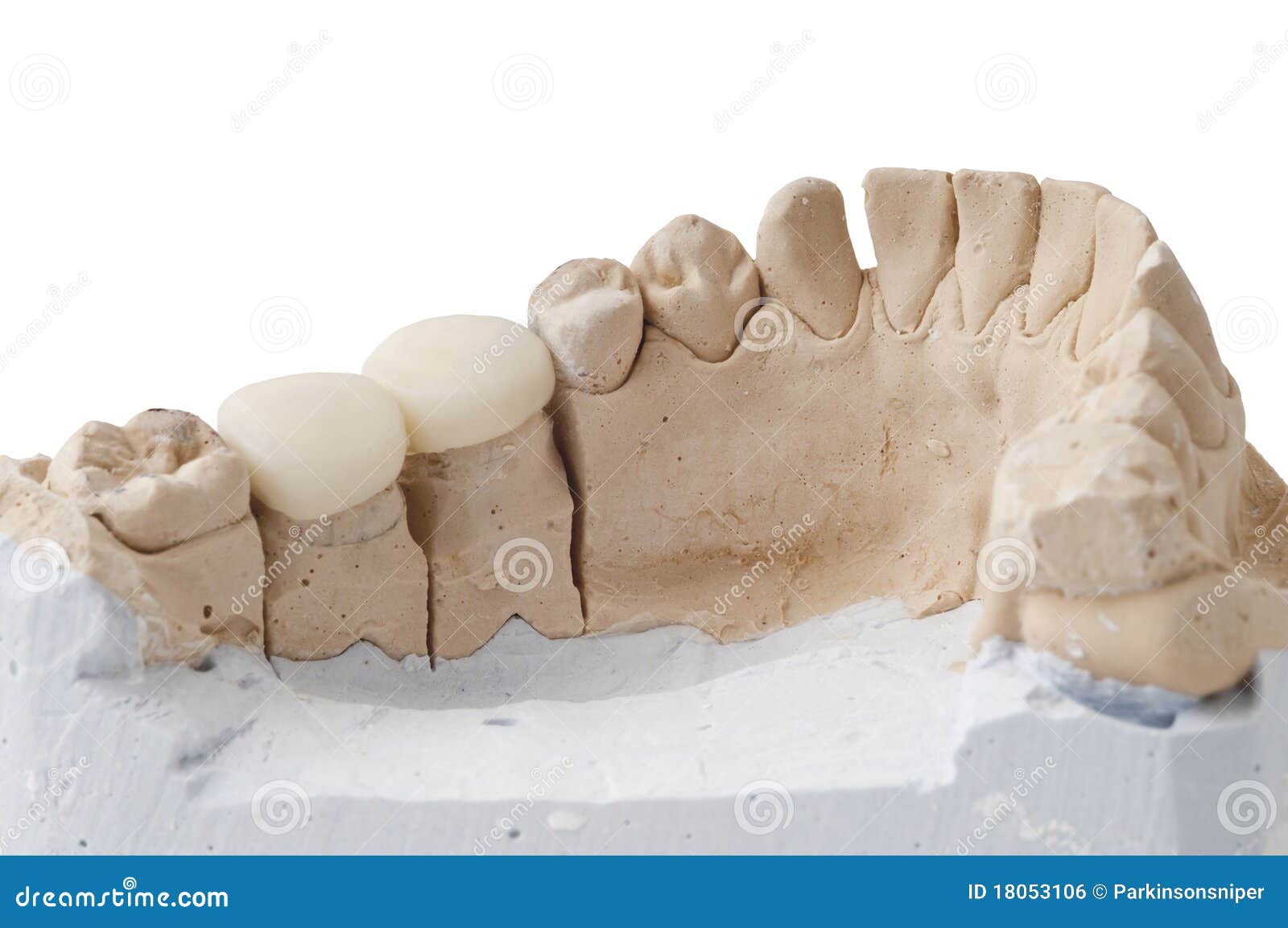 Molar And Block Of Lithium Disilicate Glass-ceramic For The CAD Stock ...