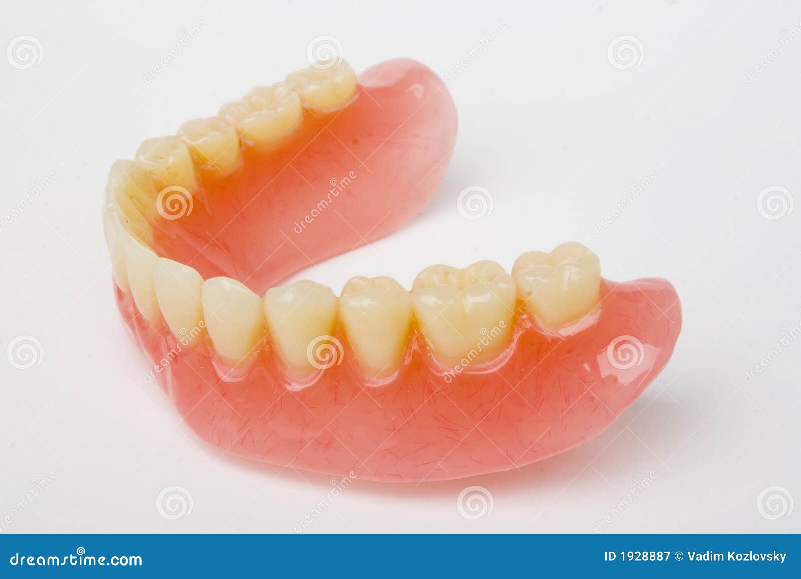 Dental prosthesis stock image. Image of denture, prosthesis - 1928887