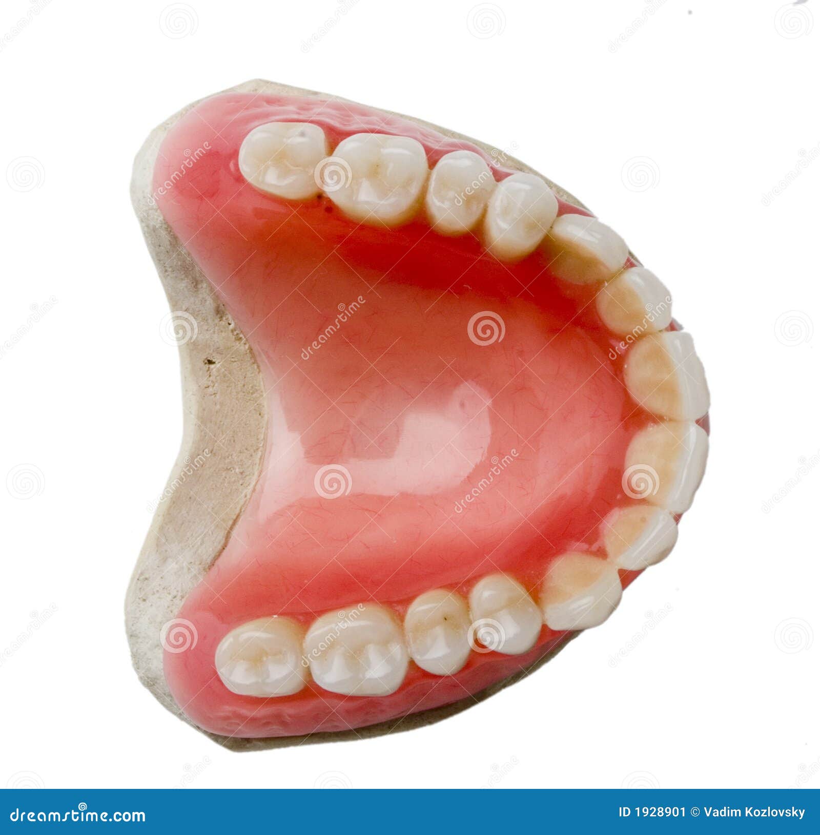Dental prosthesis stock image. Image of tooth, dentures - 1928901