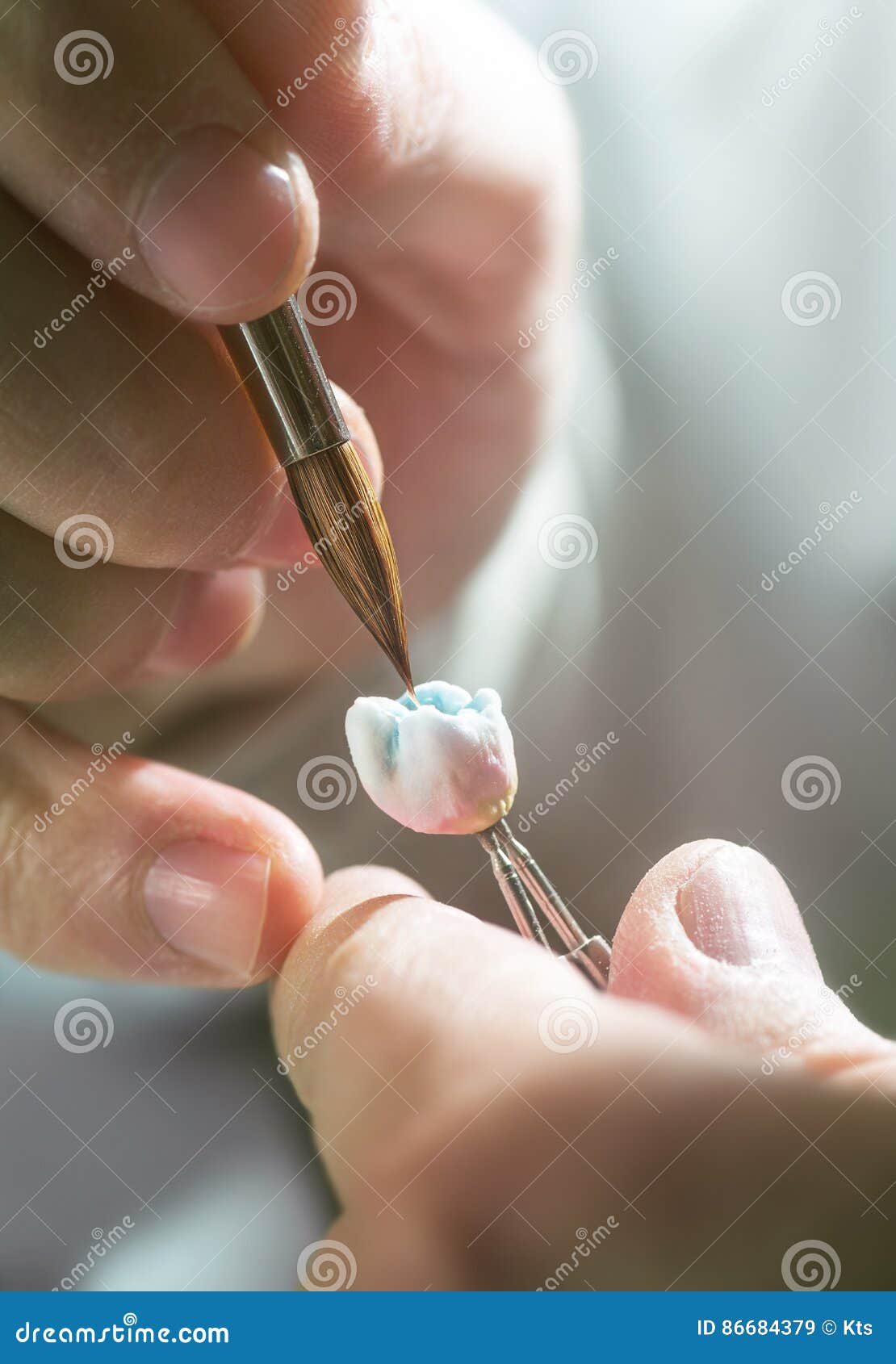 Dental Prosthesis stock image. Image of dent, medicine - 86684379