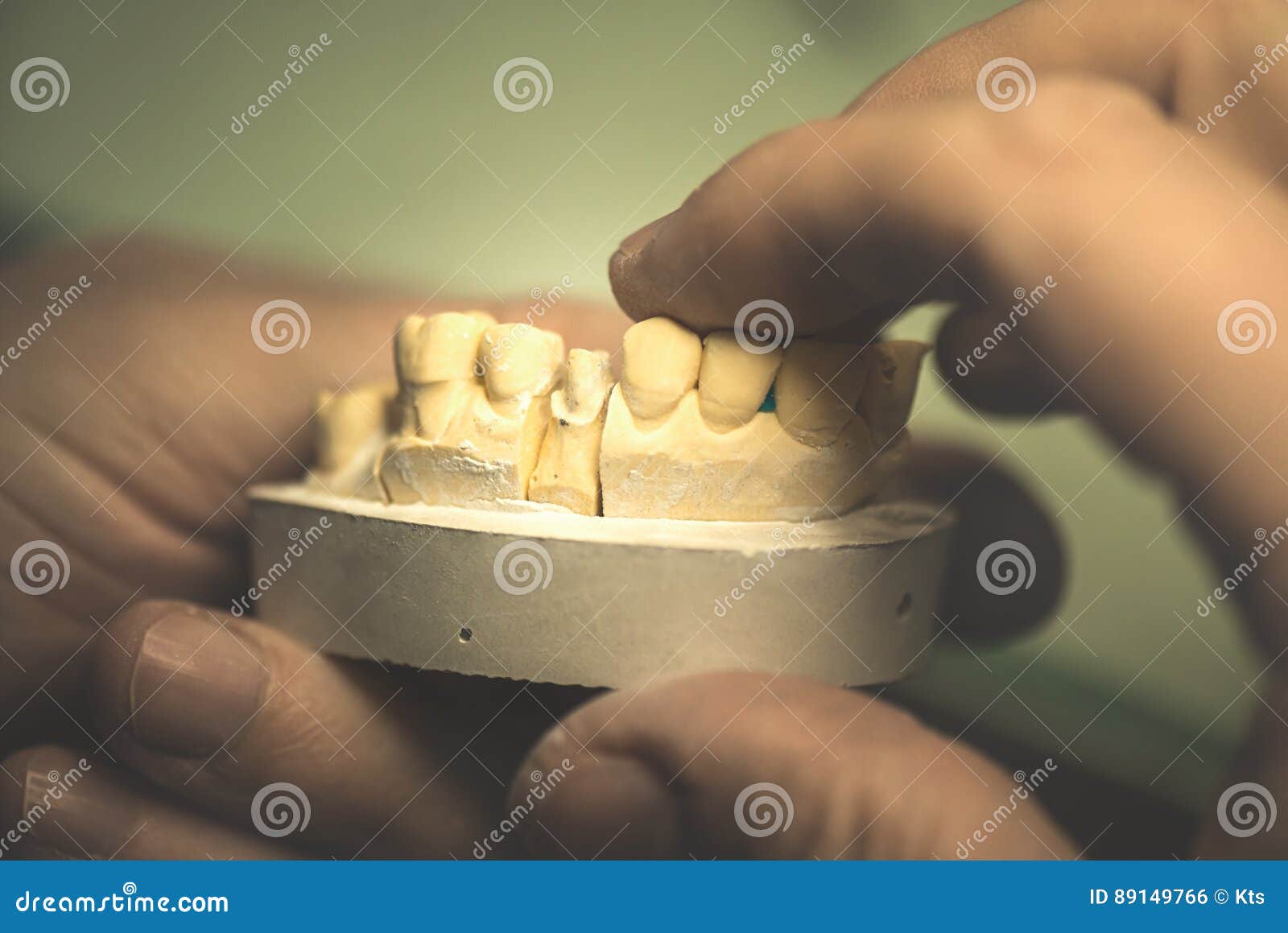 Dental Prosthesis stock photo. Image of chewing, dent - 89149766