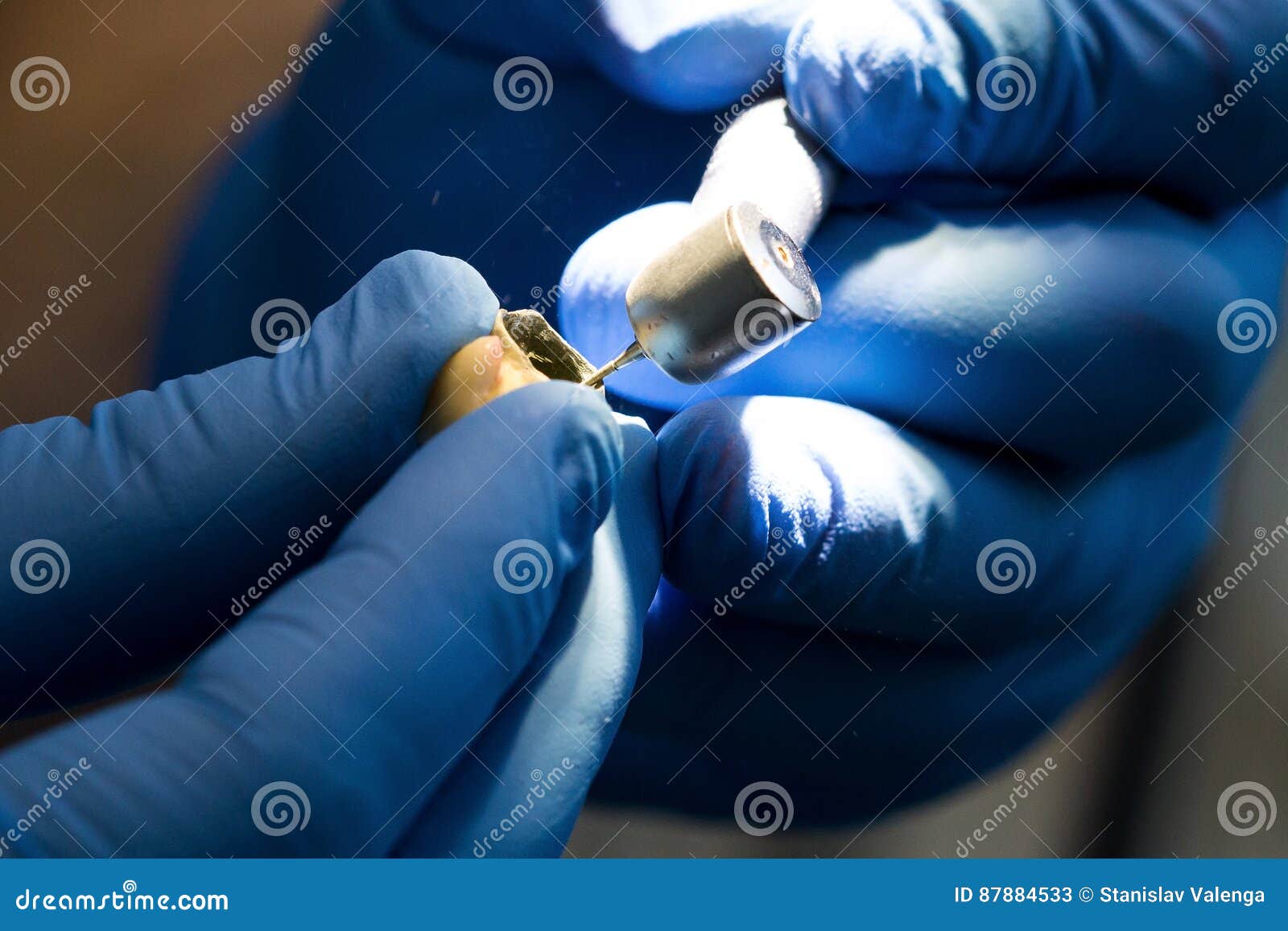 Dental Prosthesis, Dentures, Prosthetics Work. Stock Image - Image of ...