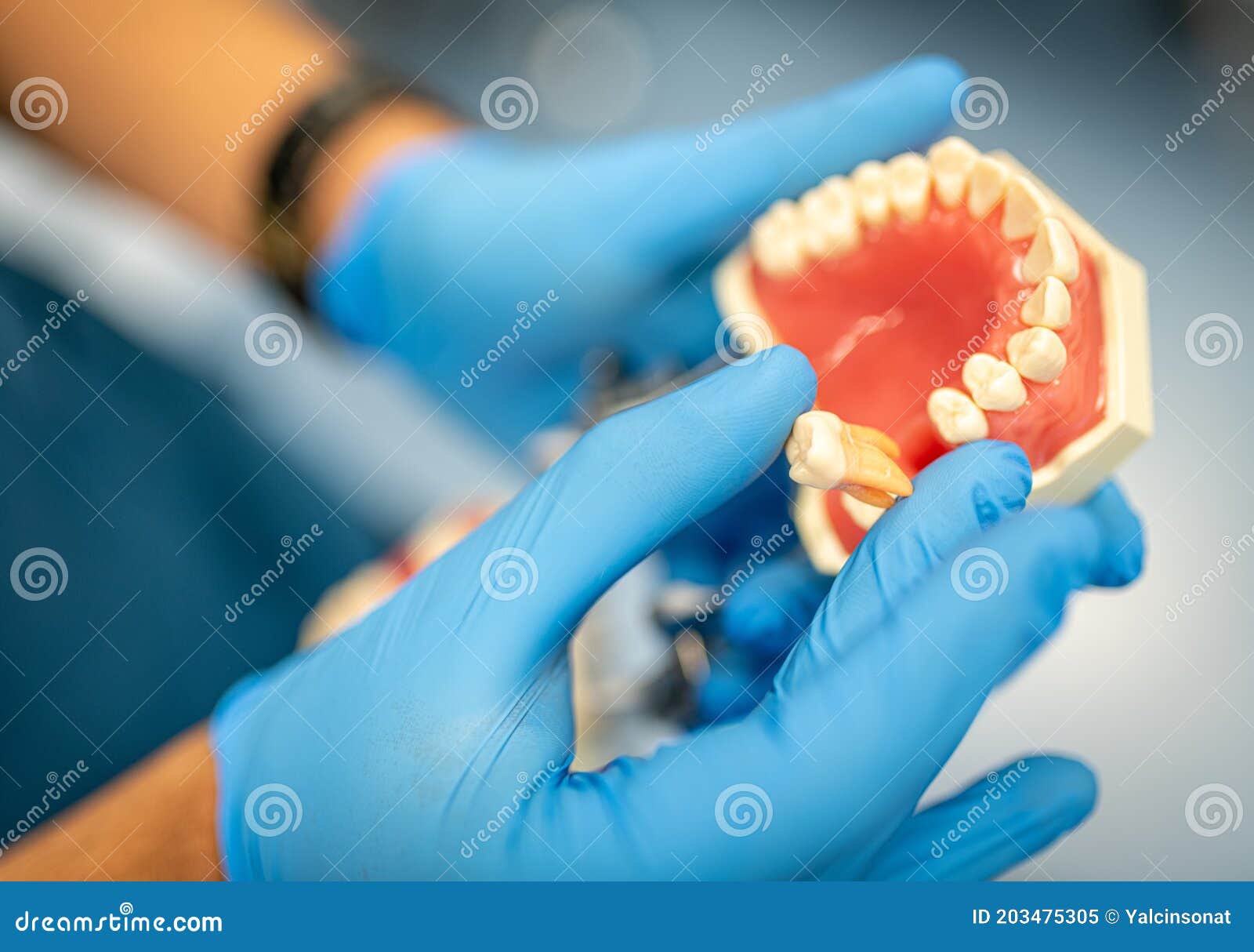 Dental Prosthesis, Dentures, Prosthetics Work. Prosthetics Hands while ...