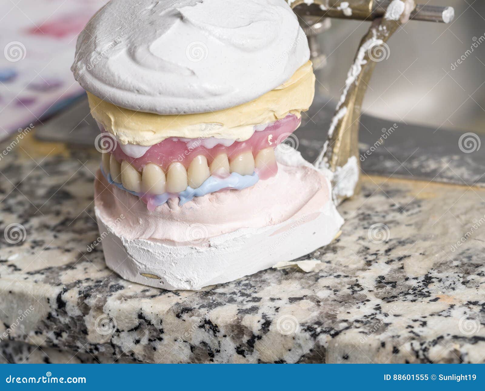 Dental Prosthesis Porcelain Teeth in a Cast Mold Stock Image - Image of ...