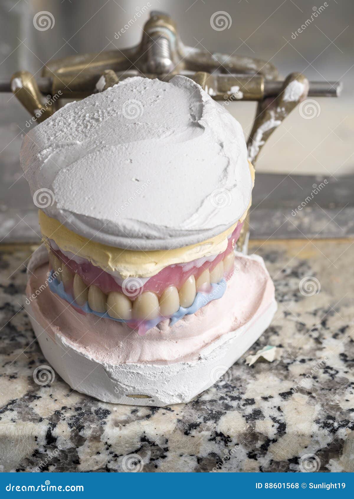 Dental Prosthesis Porcelain Teeth in a Cast Mold Stock Photo - Image of ...