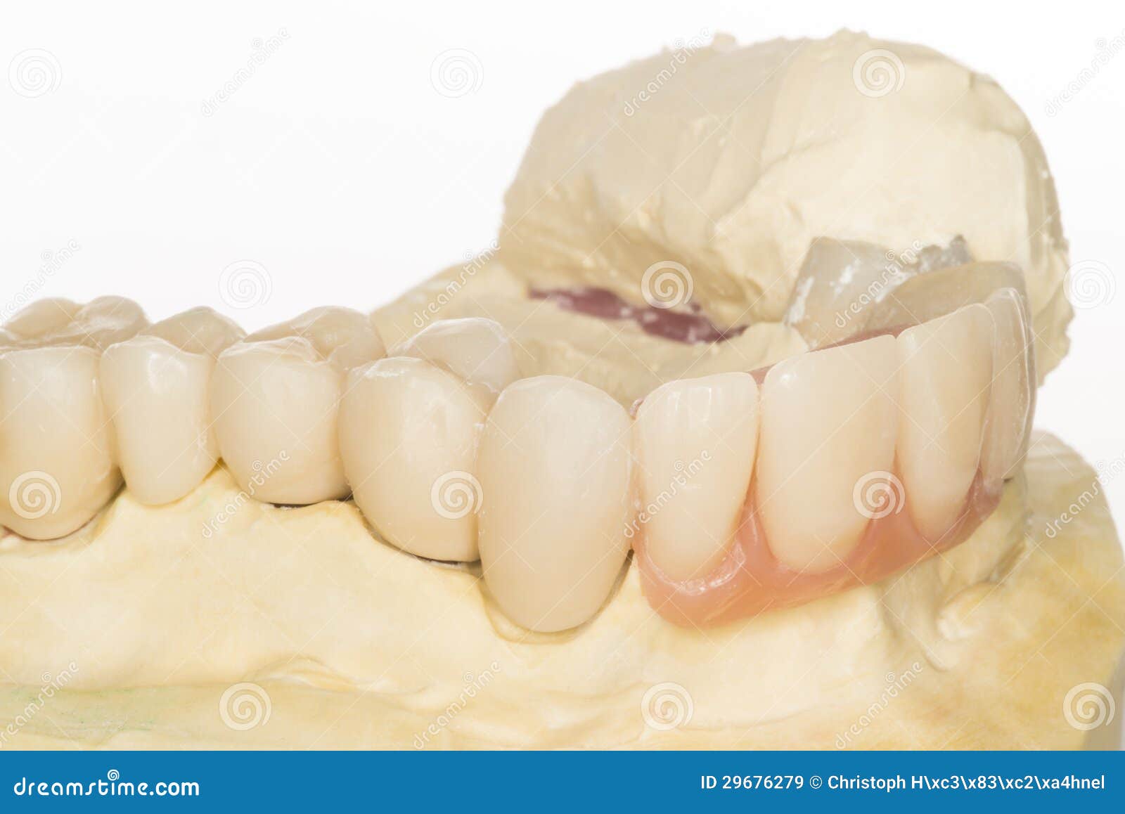 Dental prothesis stock image. Image of tooth, orthodontist - 29676279