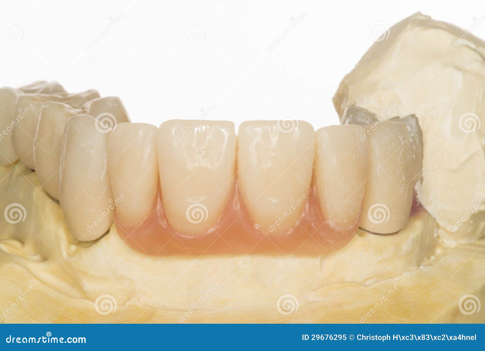 Dental prothesis stock image. Image of hygiene, laboratory - 29676295