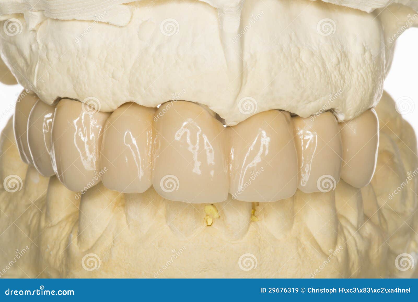 Dental prothesis stock image. Image of laboratory, oral - 29676319