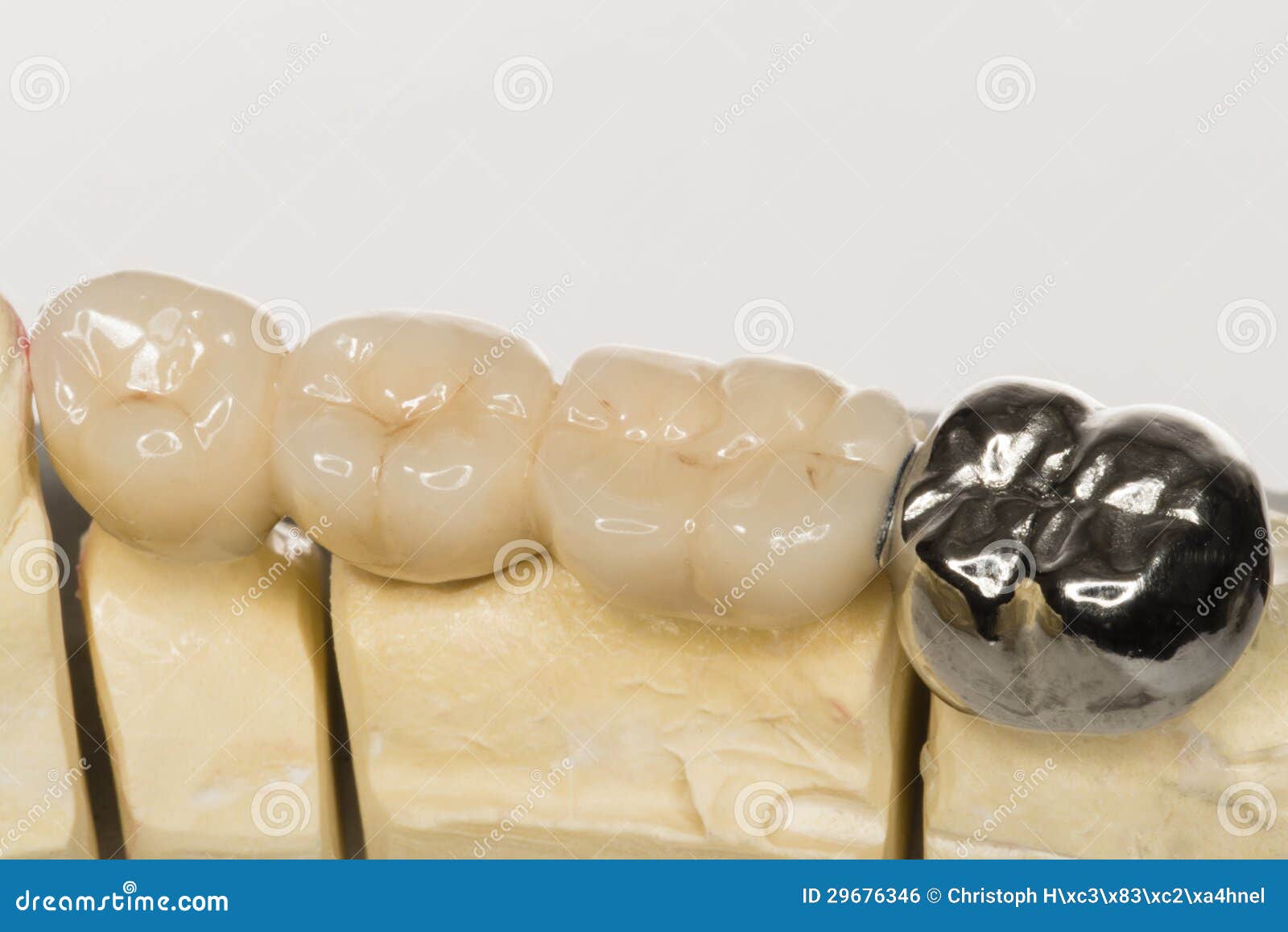 Dental prothesis stock photo. Image of surgeon, prosthesis - 29676346