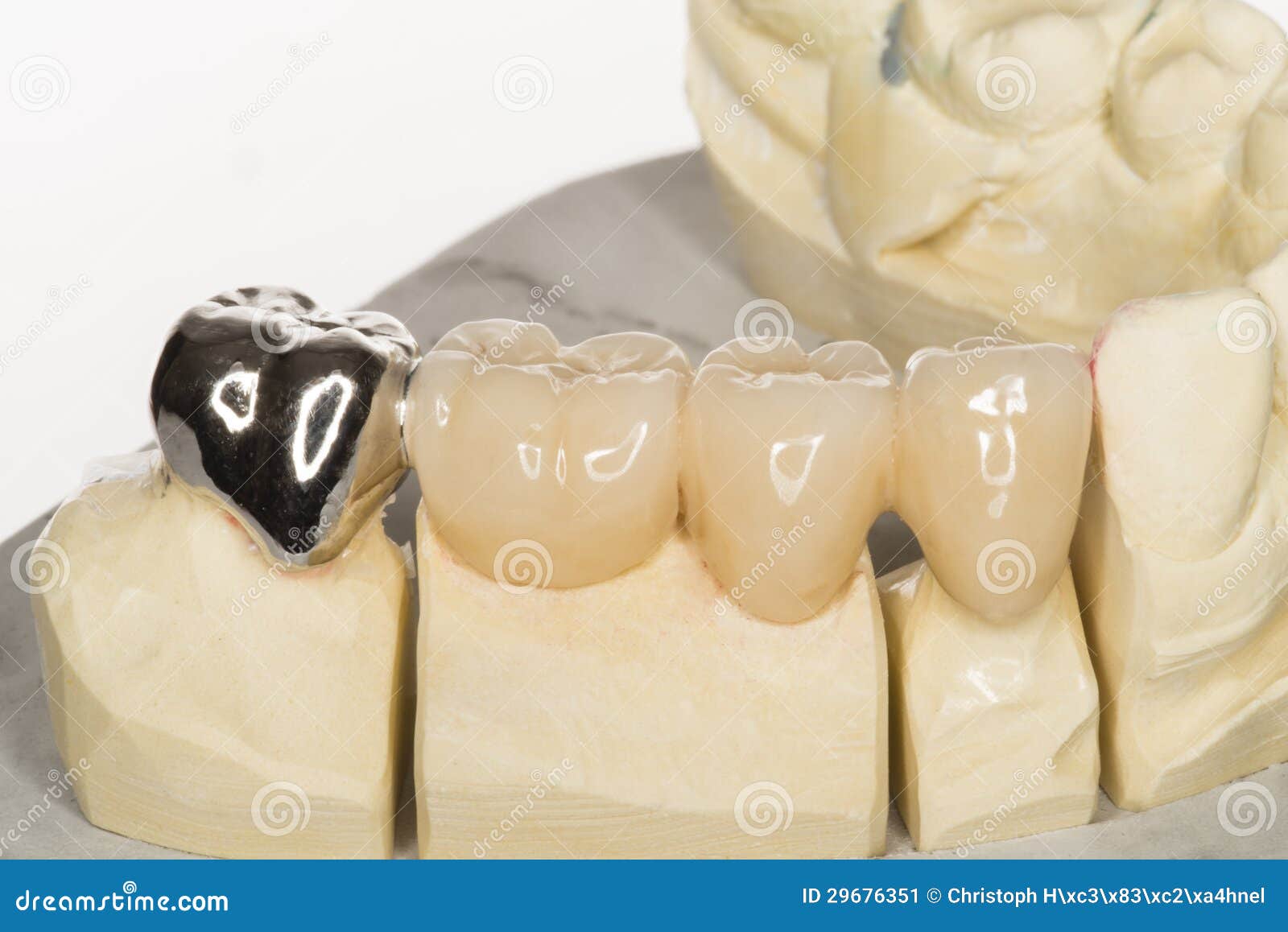 Dental prothesis stock image. Image of dentist, teeth - 29676351