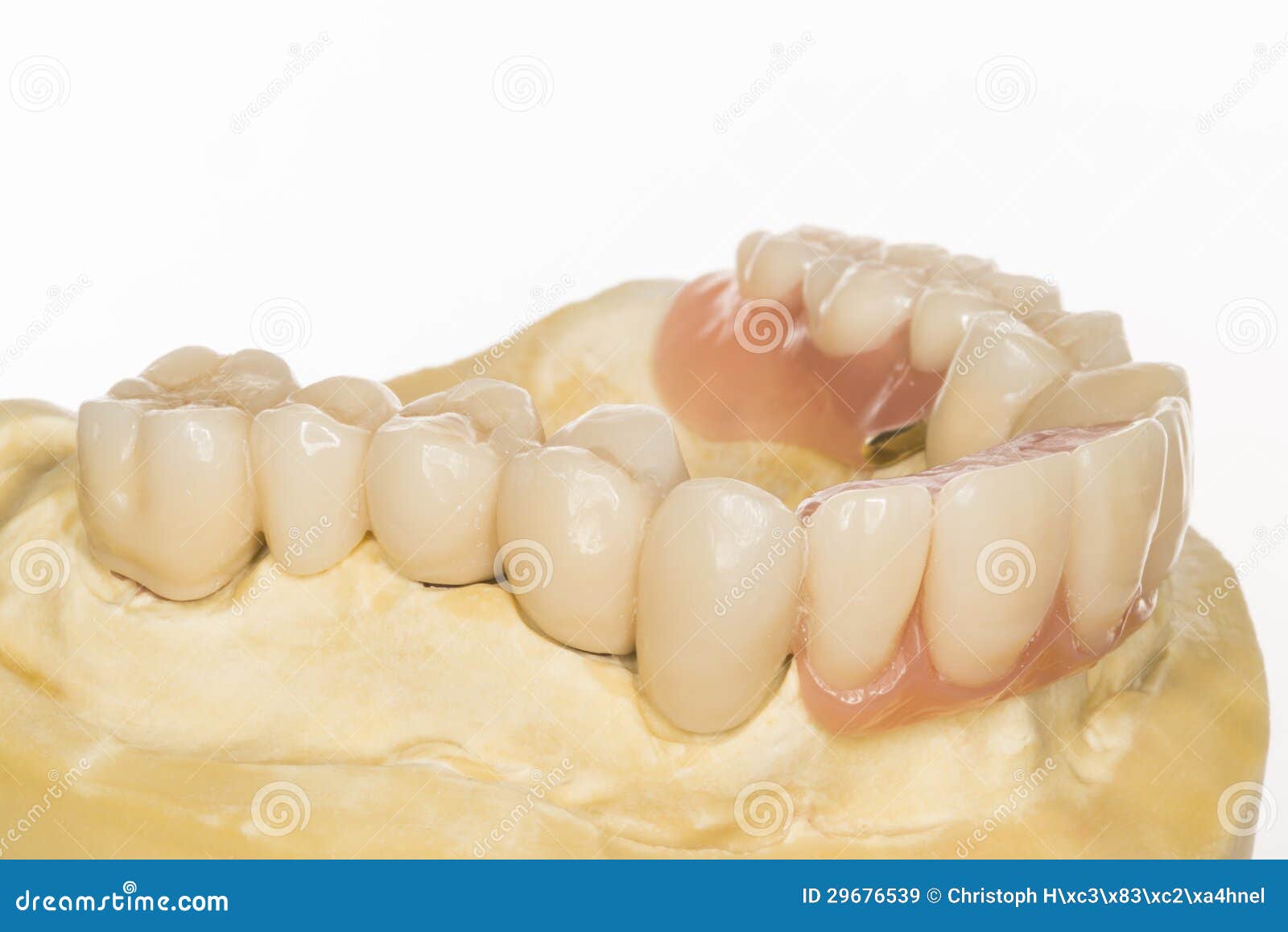 Dental prothesis stock image. Image of laboratory, oral - 29676539