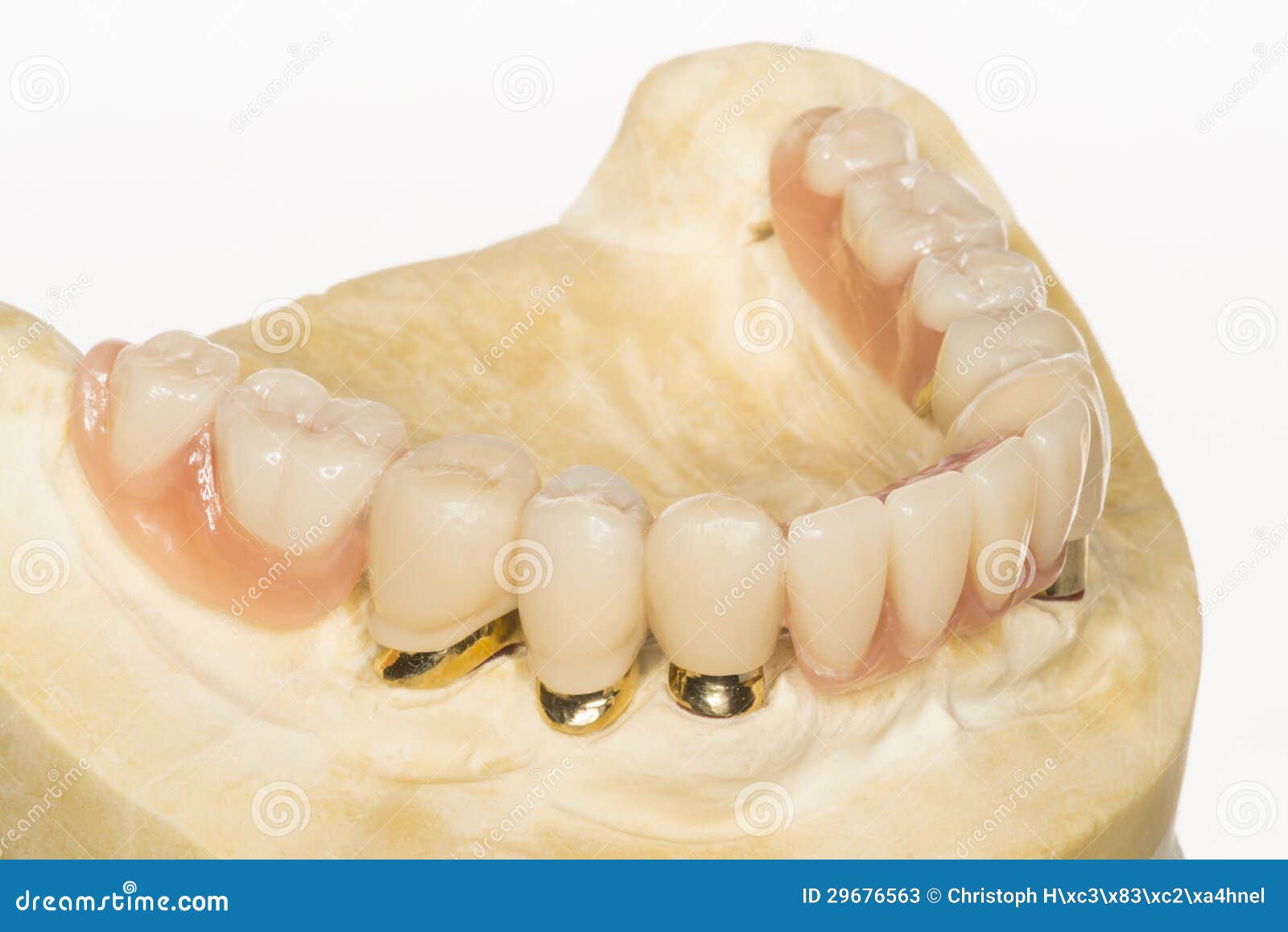 Dental prothesis stock image. Image of tooth, surgeon - 29676563