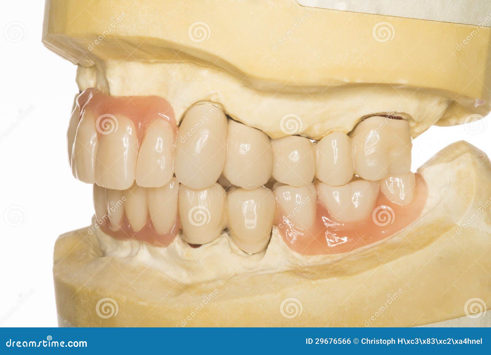 Dental prothesis stock photo. Image of prosthesis, teeth - 29676566