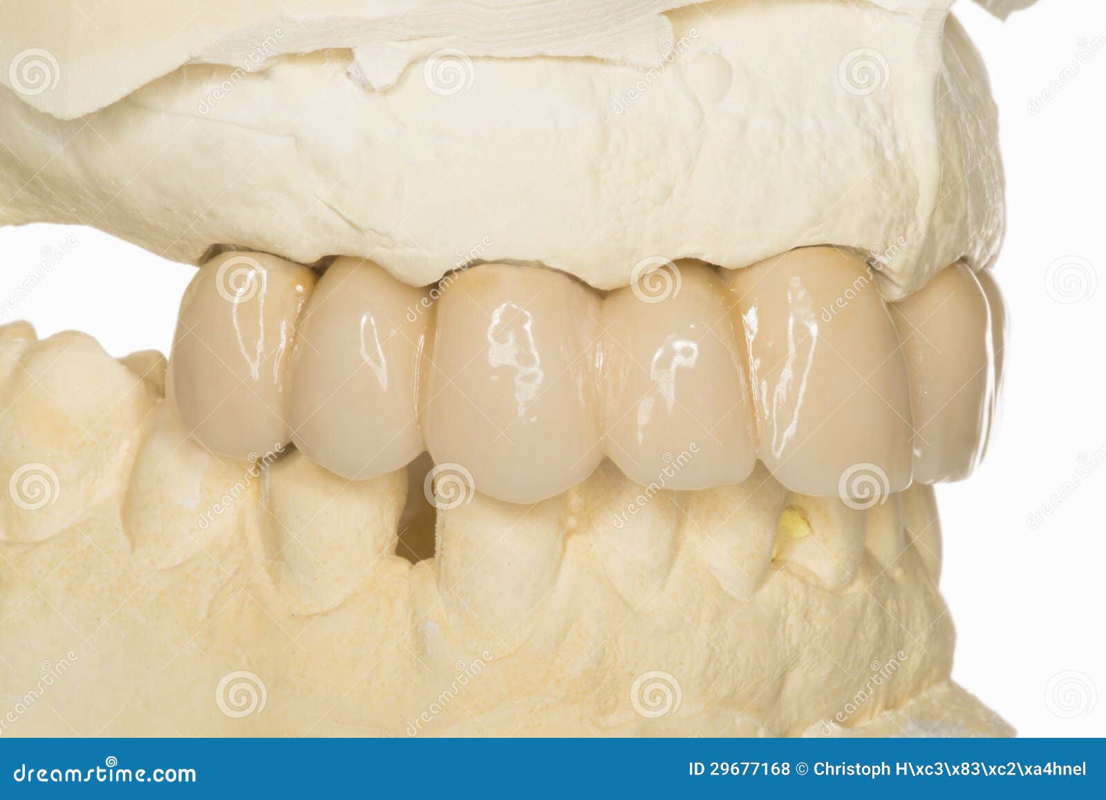 Dental prothesis stock photo. Image of dentist, teeth - 29677168