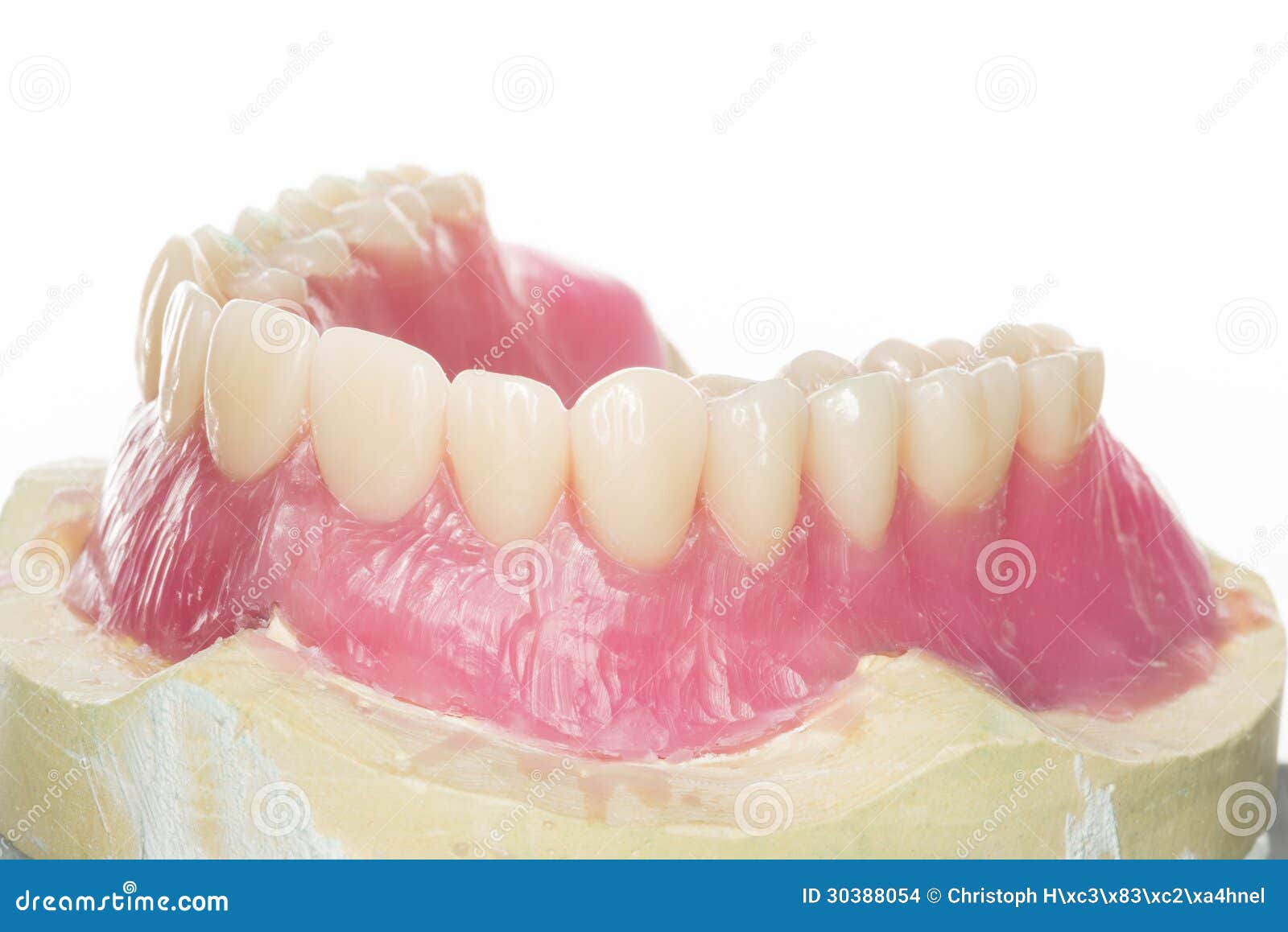 Dental prothesis stock photo. Image of telescope, dental - 30388054