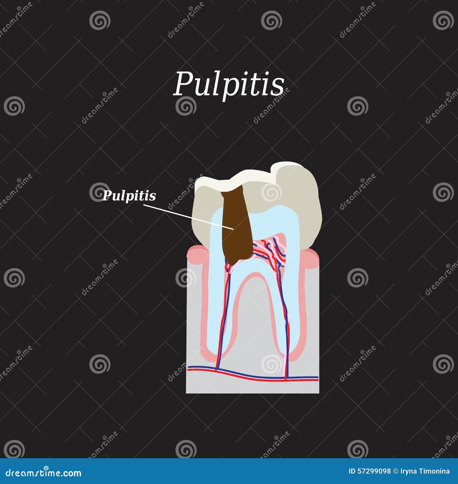 Dental Pulp Line Icon. Vector Illustration | CartoonDealer.com #80698162