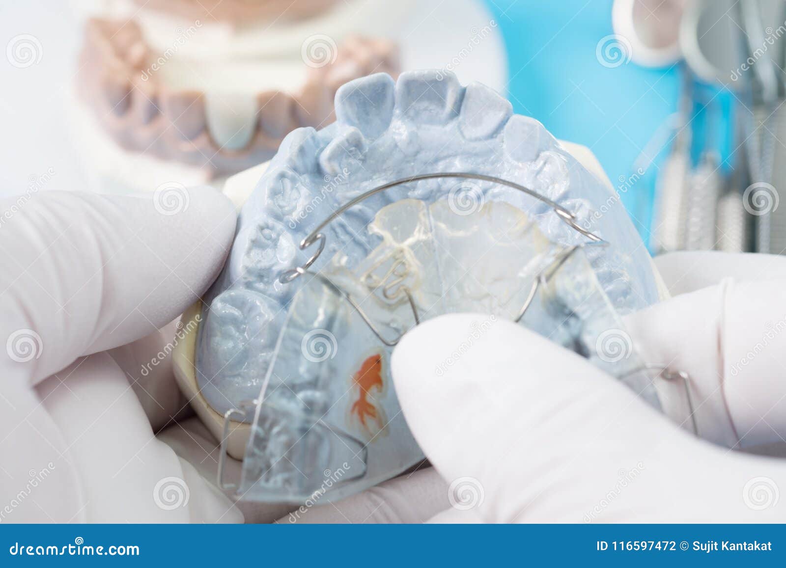 Dental Retainer Orthodontic Appliance. Stock Photo - Image of dentistry ...