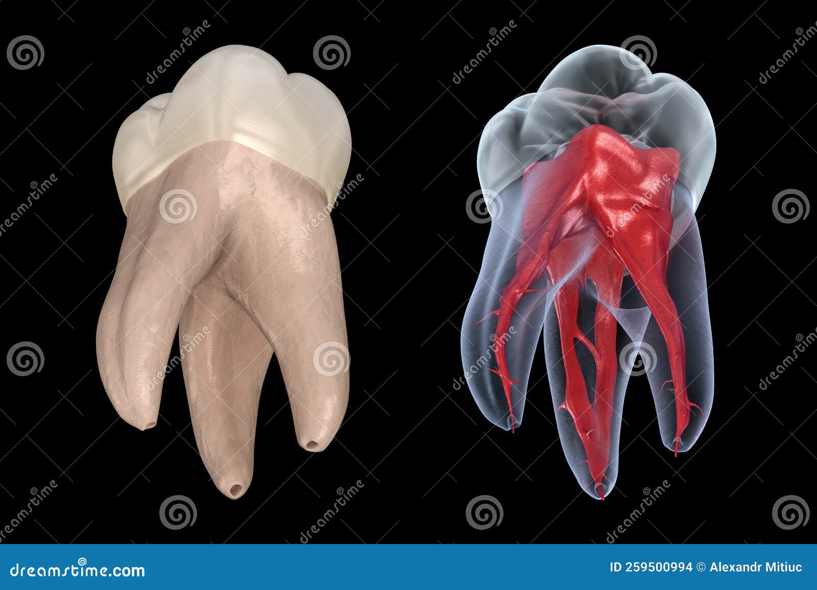 Dental Root Anatomy - First Maxillary Molar Tooth. Medically Accurate ... Dental Root Anatomy - First Maxillary Molar Tooth. Medically Accurate ...