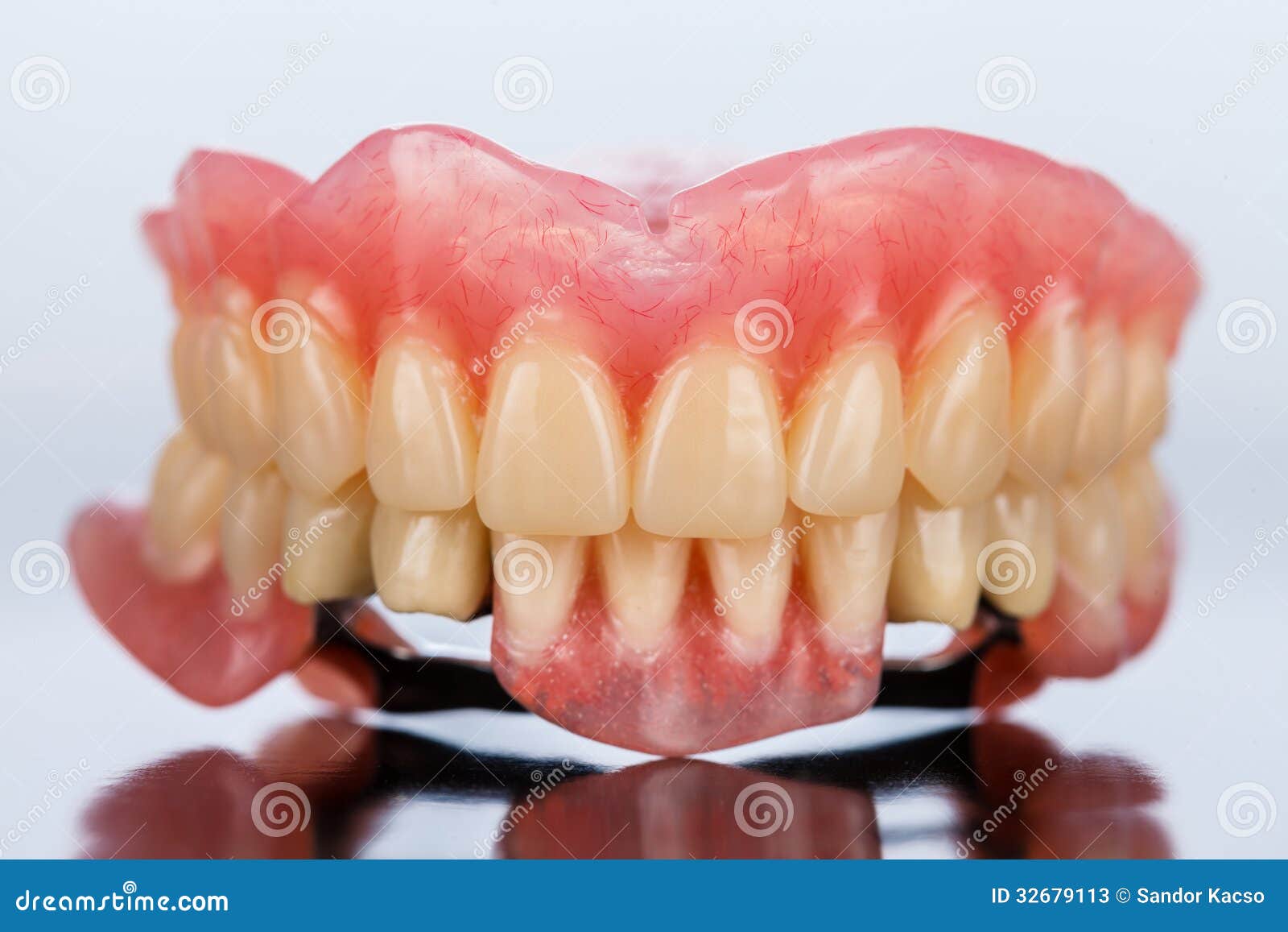 Dental Skeletal Prosthesis - Front View Stock Image - Image of ...