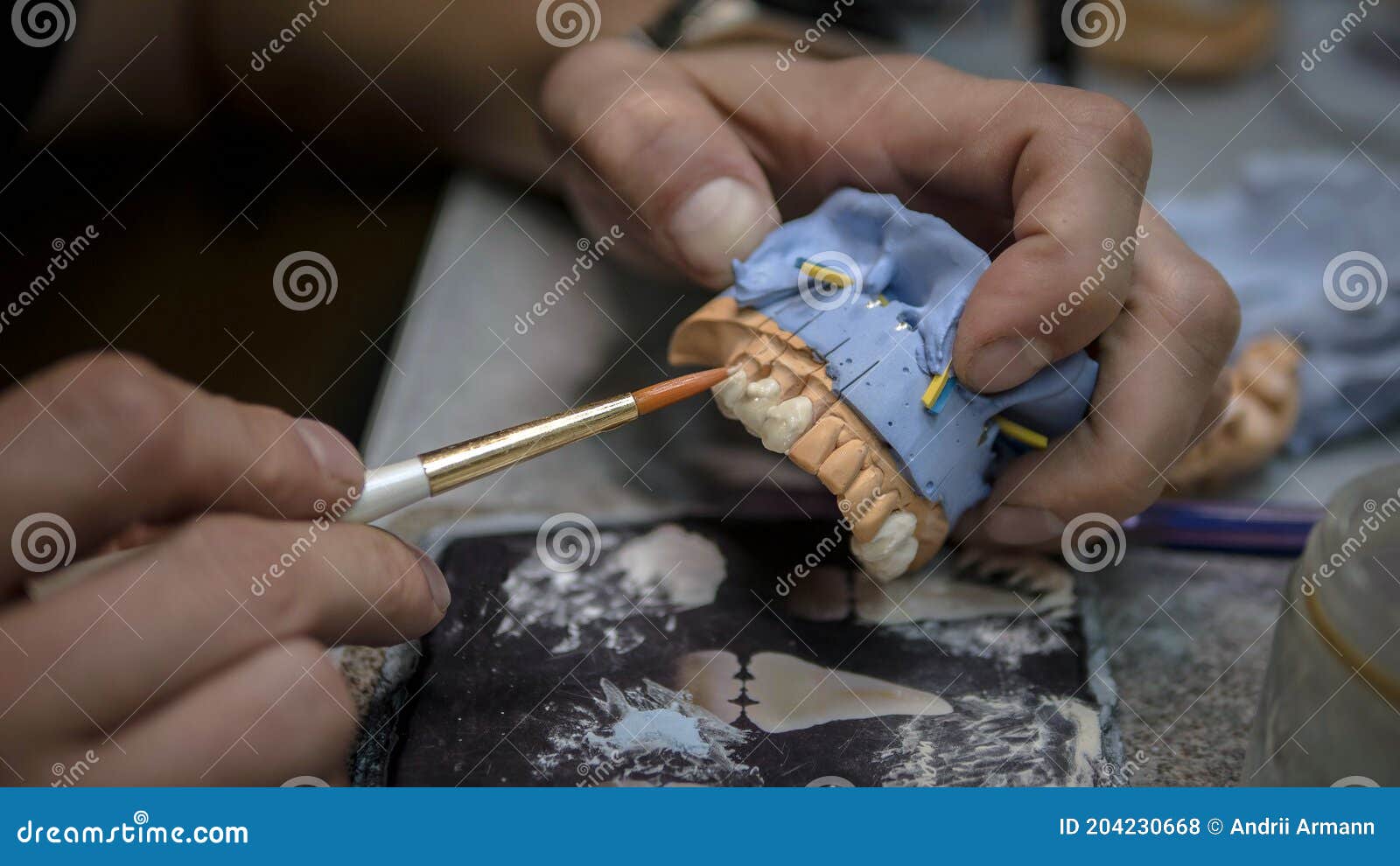 Dental Technician, Dentures on a Mock-up, Teeth Making. Plaster Model ...
