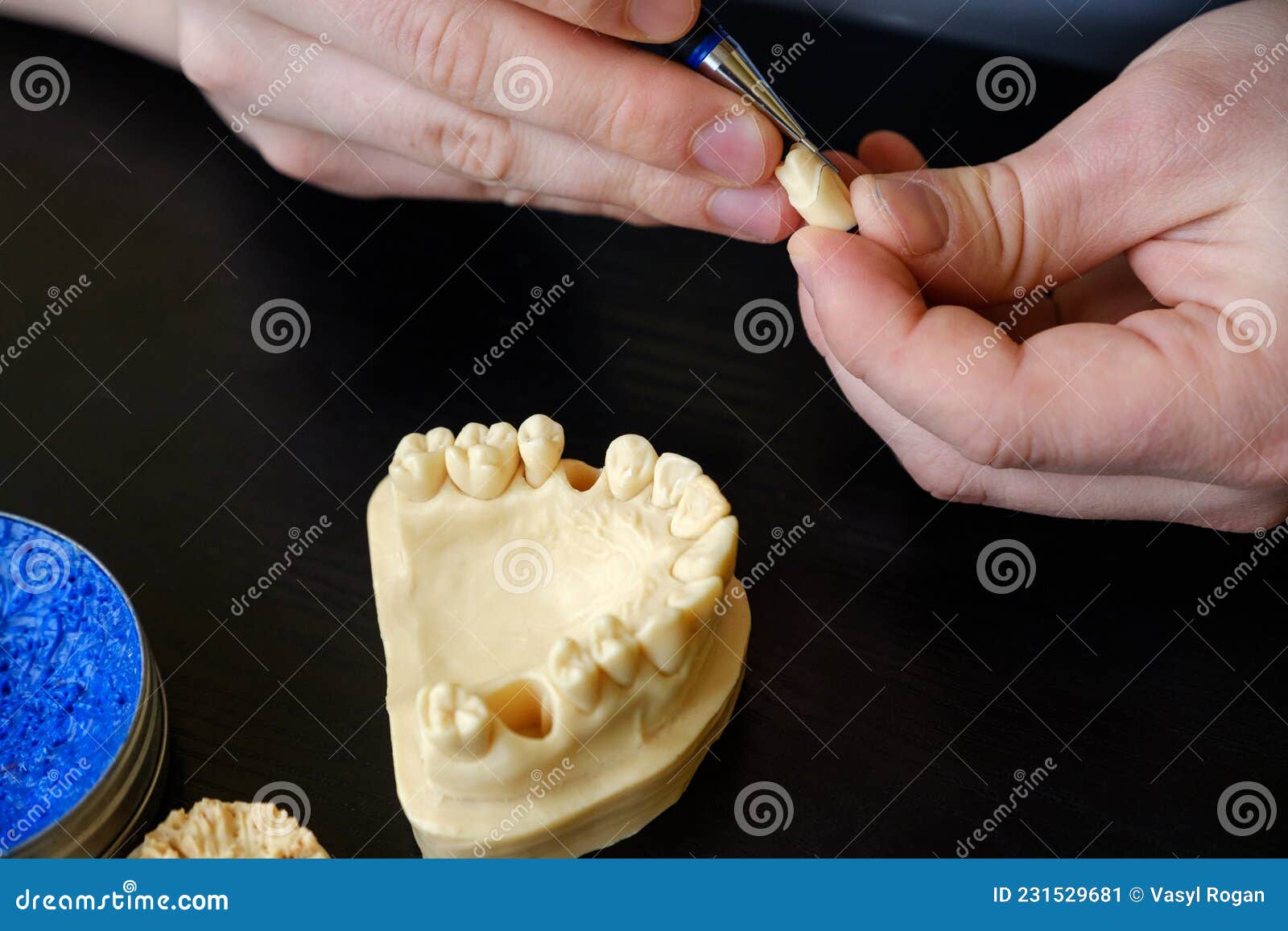 The Dental Technician is Engaged in a Modeling of Artificial Dentures ...