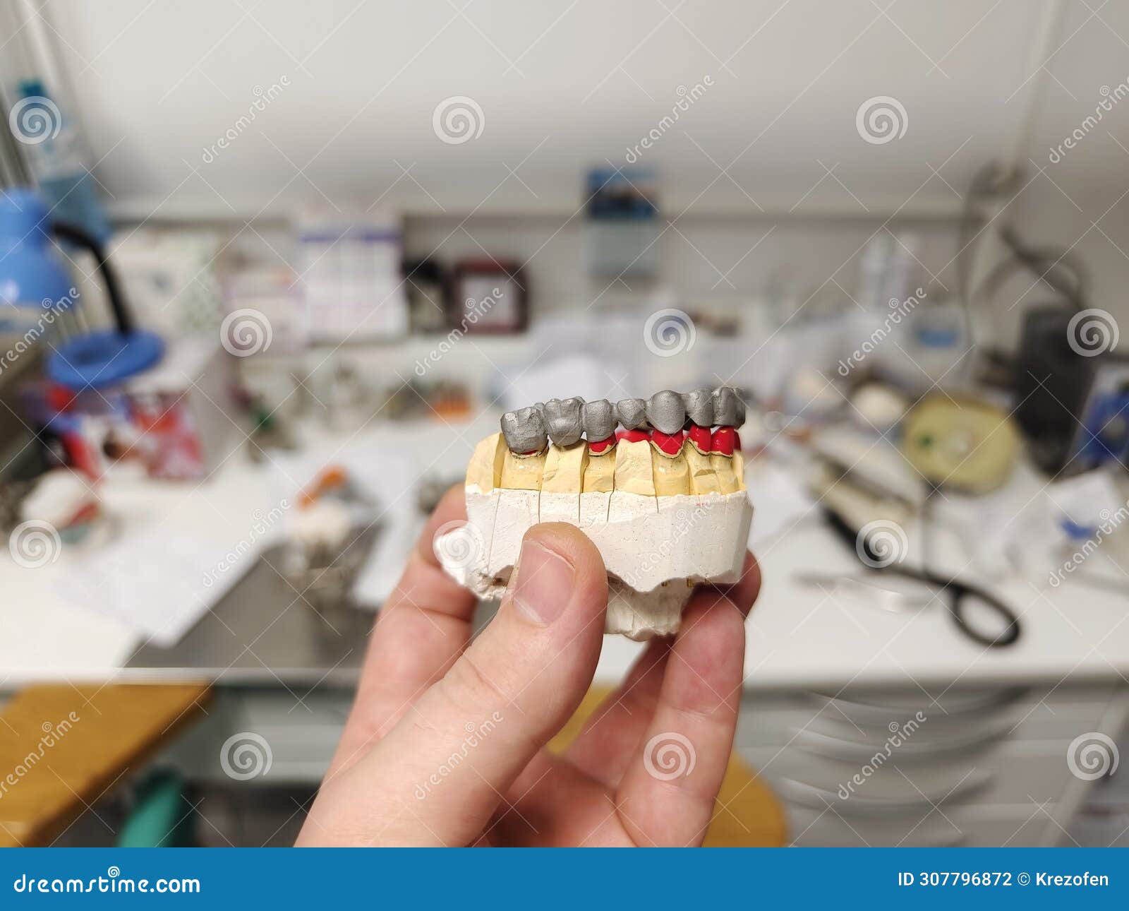 Dental Technician Holds a Model with a Metal-ceramic Denture Stock ...