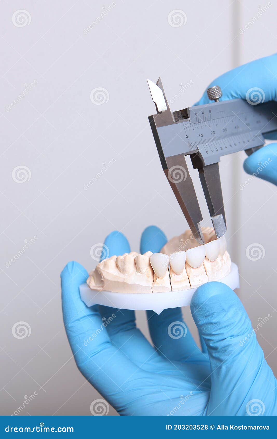 A Dental Technician Makes the Measurement of the Veneers. Ceramic and ...
