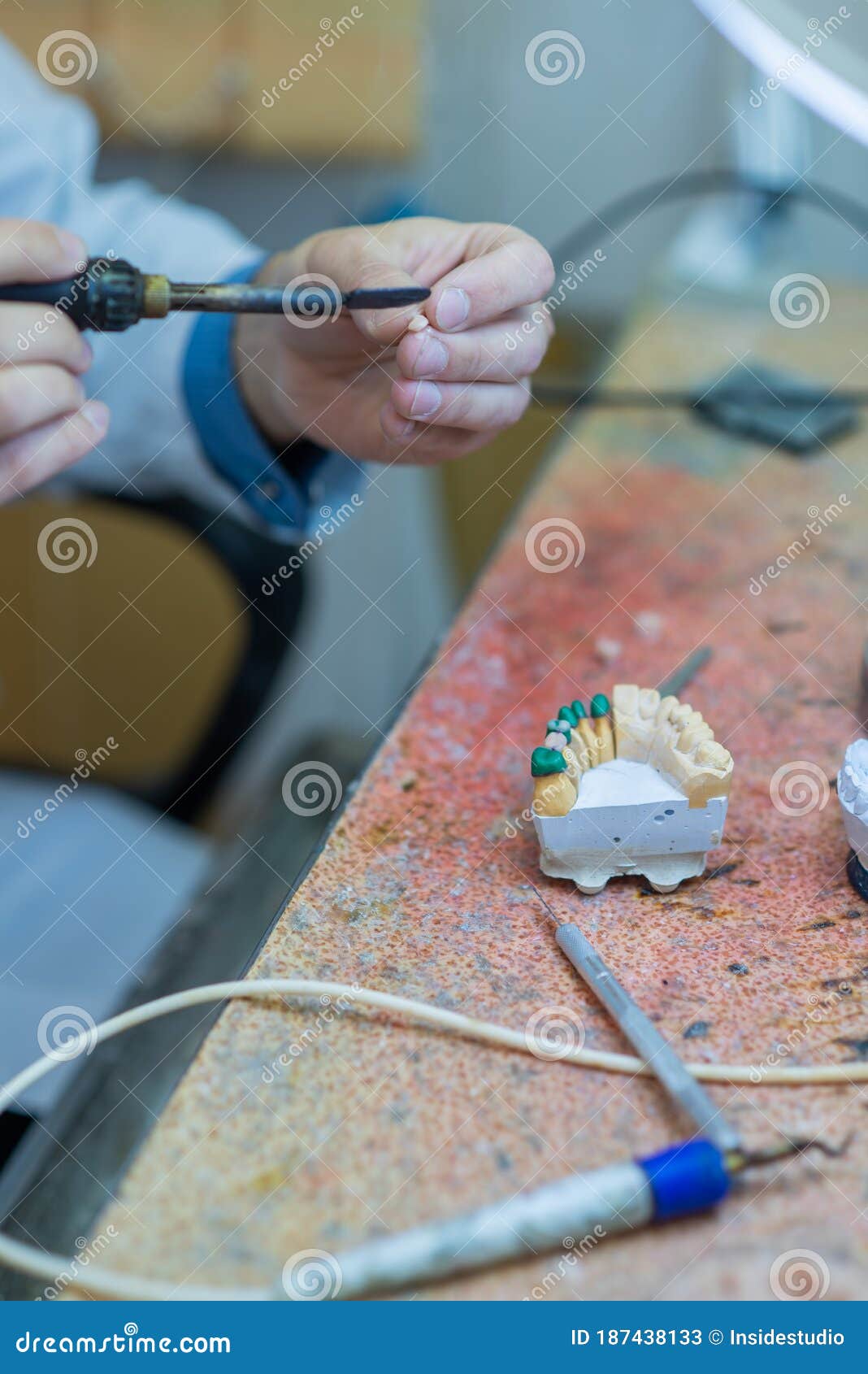 A Dental Technician Makes Partial Dentures. the Production of False ...