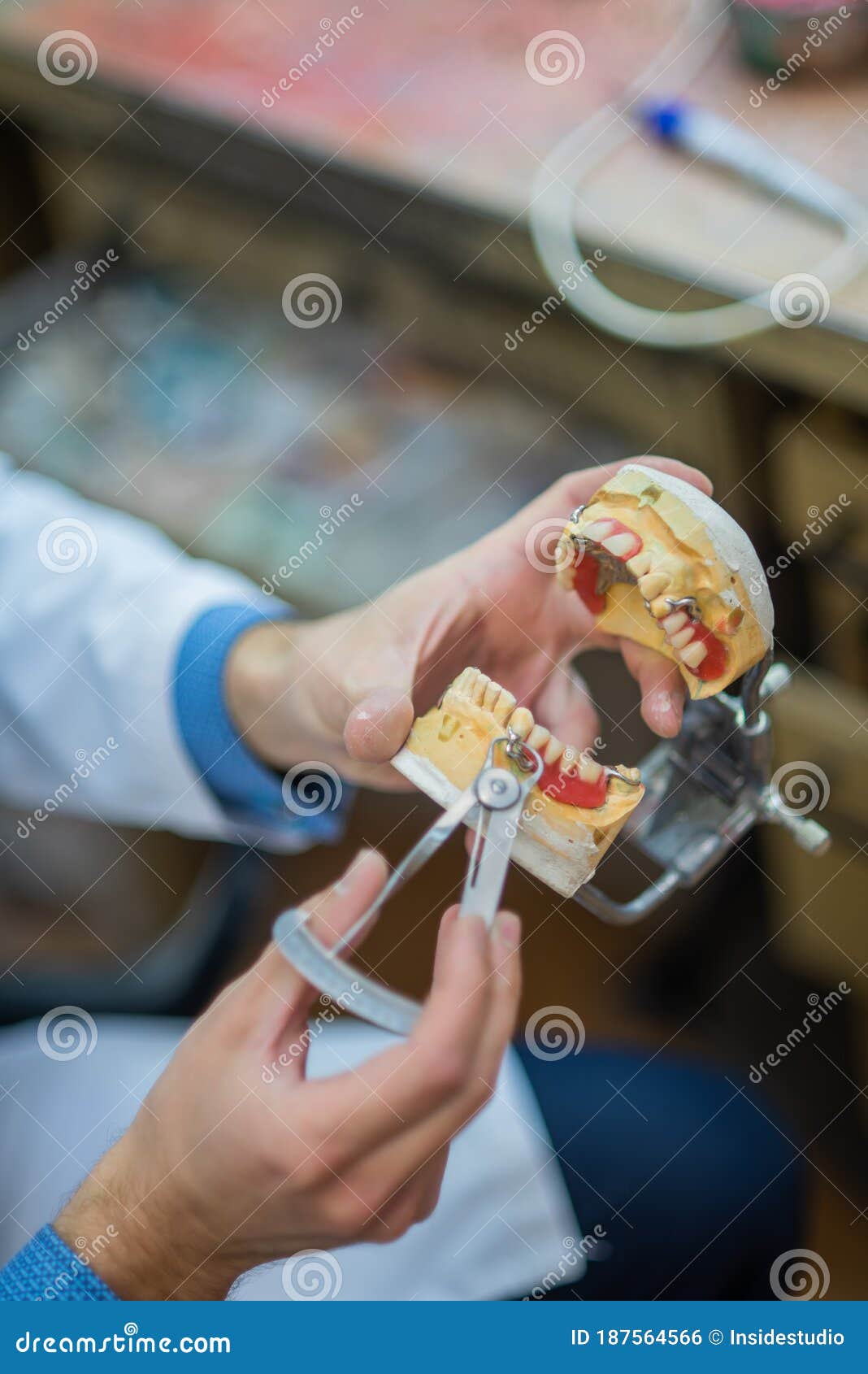 A Dental Technician Makes Partial Dentures. the Production of False ...