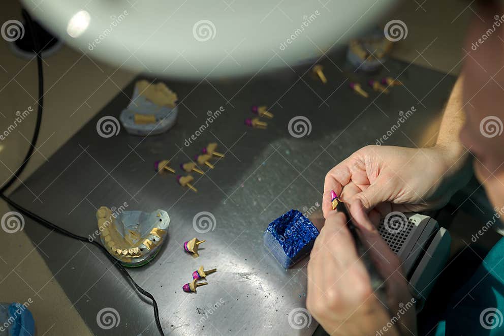 Dental Technician Preparing Teeth for Ceramic Castingdental Technician ...