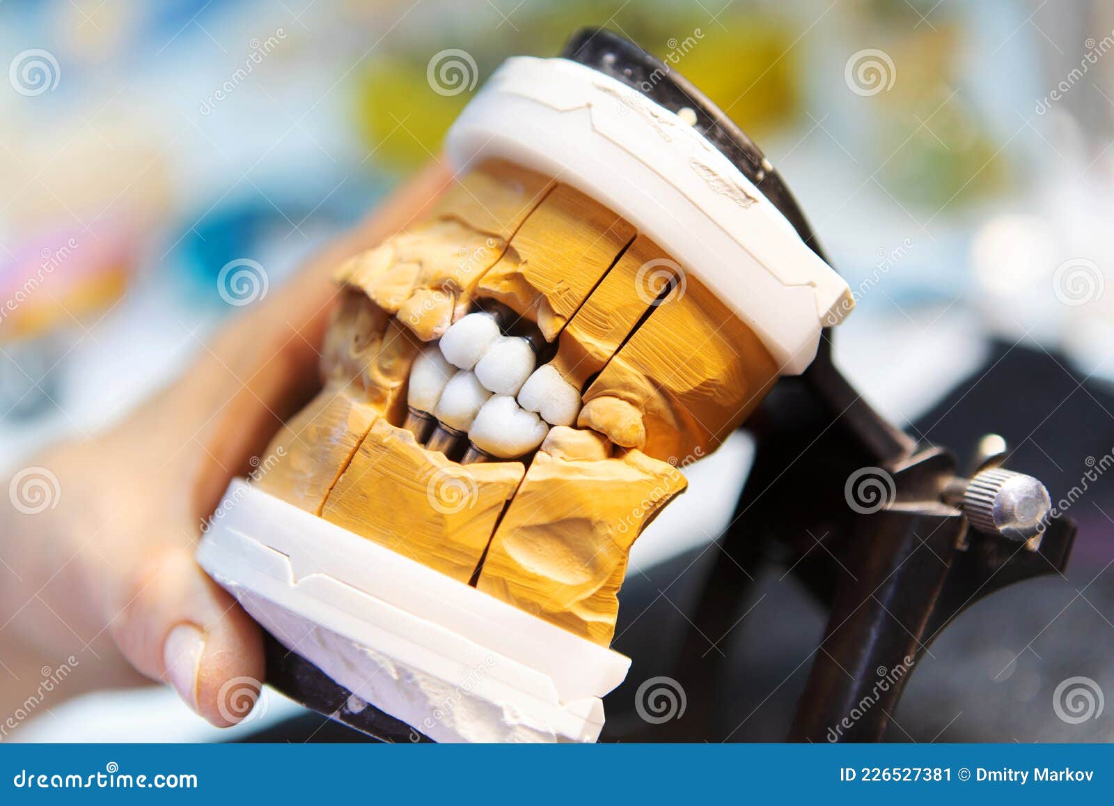 Dental Technician. Restoration of Teeth in a Dental Clinic Stock Image ...