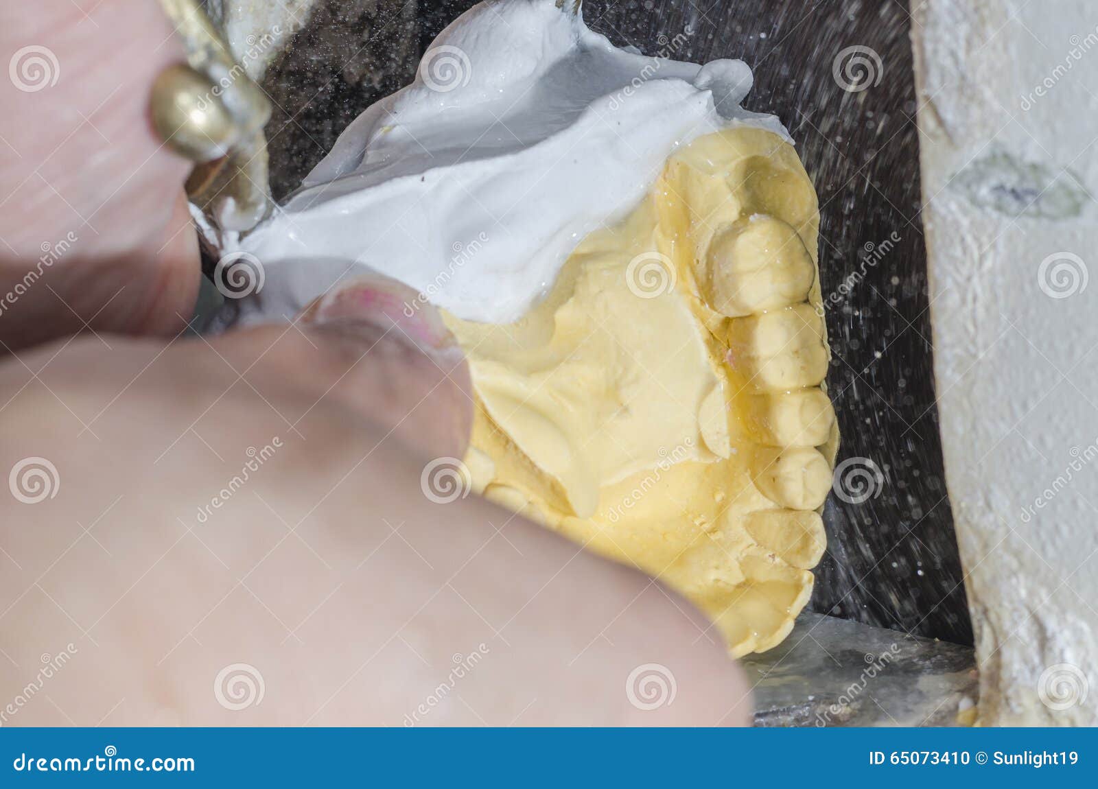 Dental Technician Sanding Plaster Models. Stock Photo - Image of metal ...