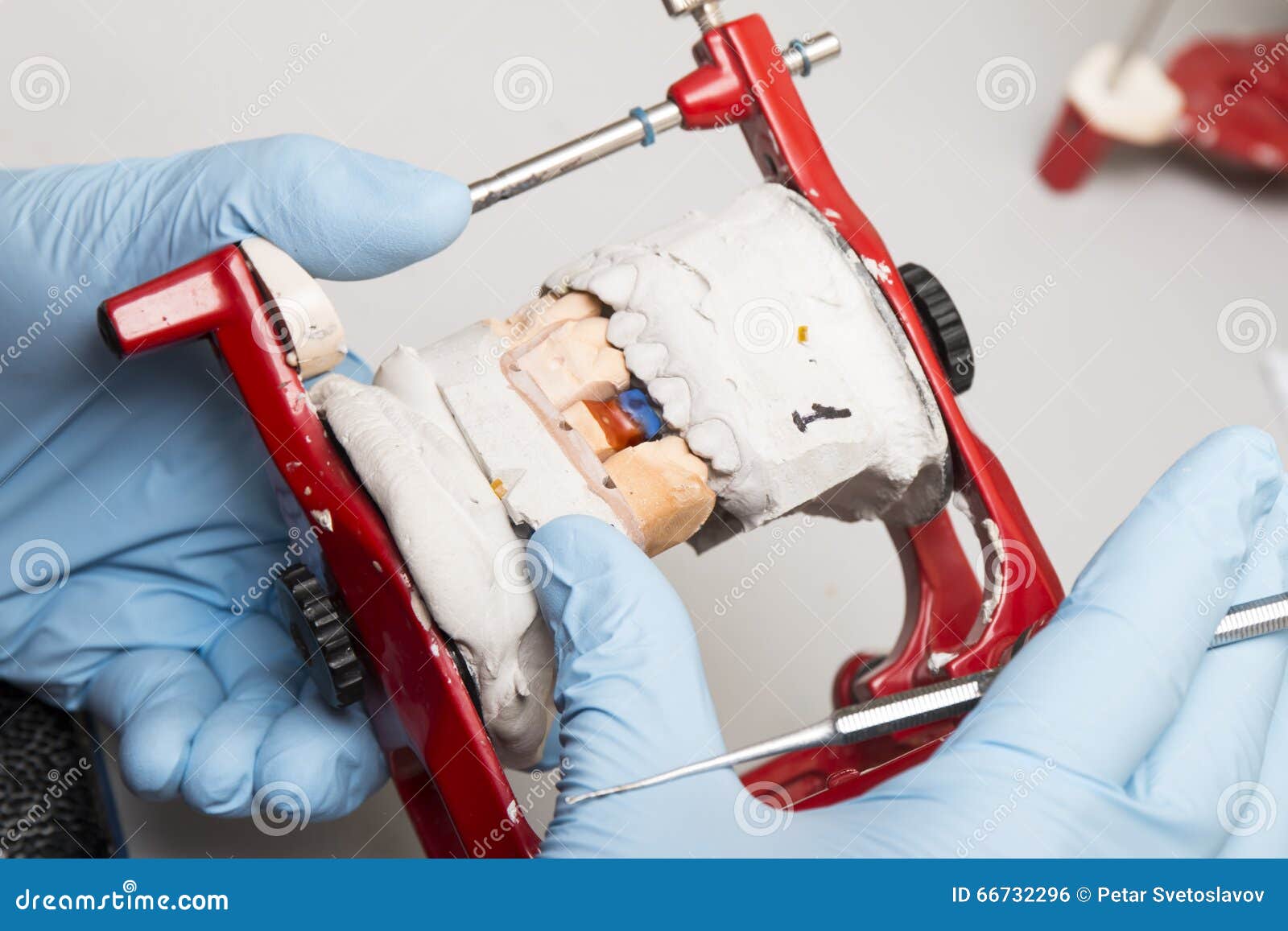 Dental Technician Showing Tooth Dentures Stock Photo - Image of health ...