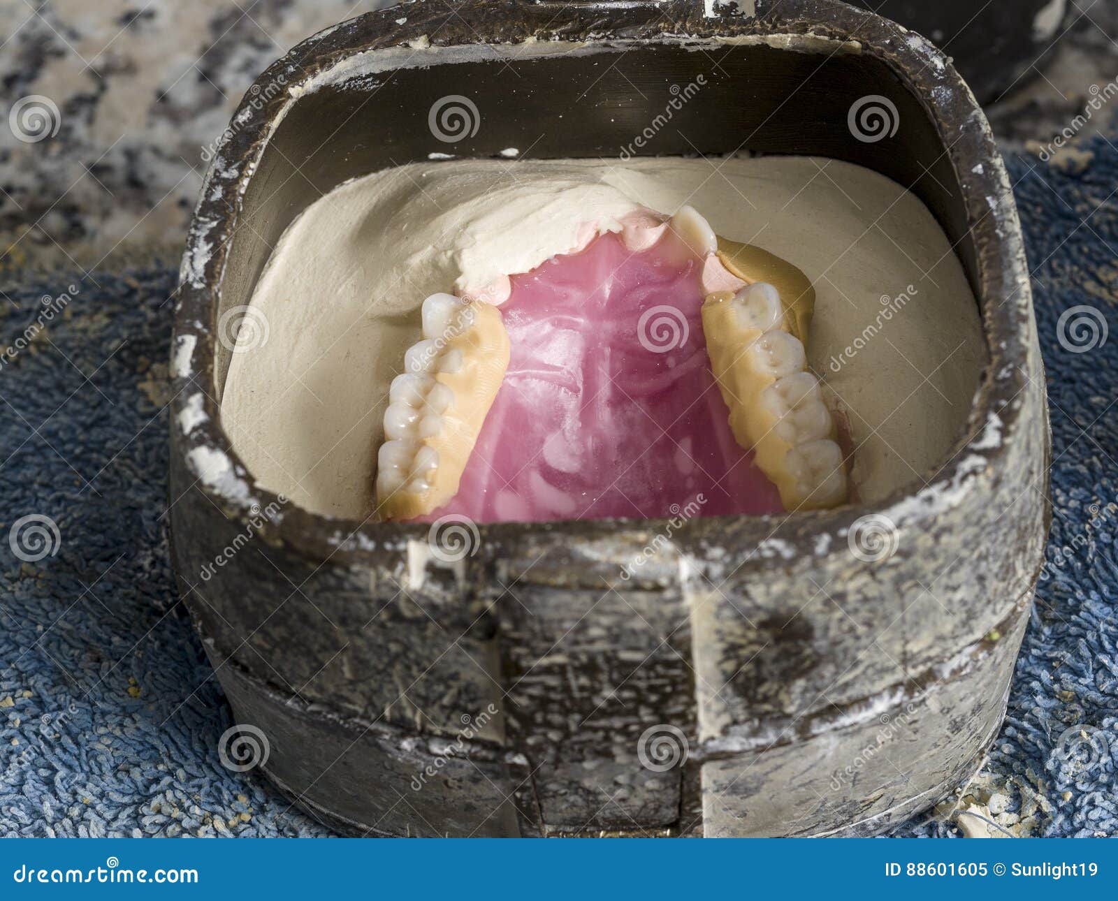 Dental Technician is Working with a Dental Flask of a Complete U Stock ...