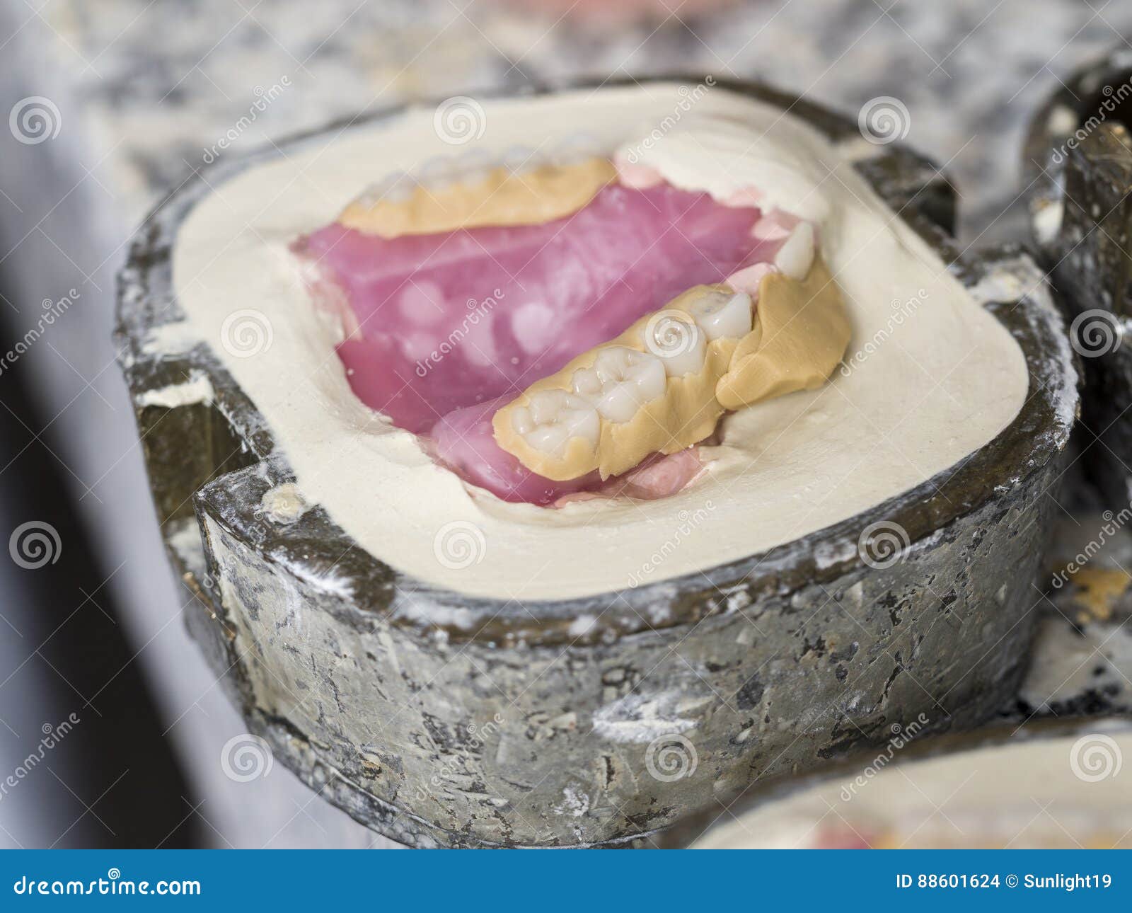 Dental Technician is Working with a Dental Flask of a Complete U Stock ...