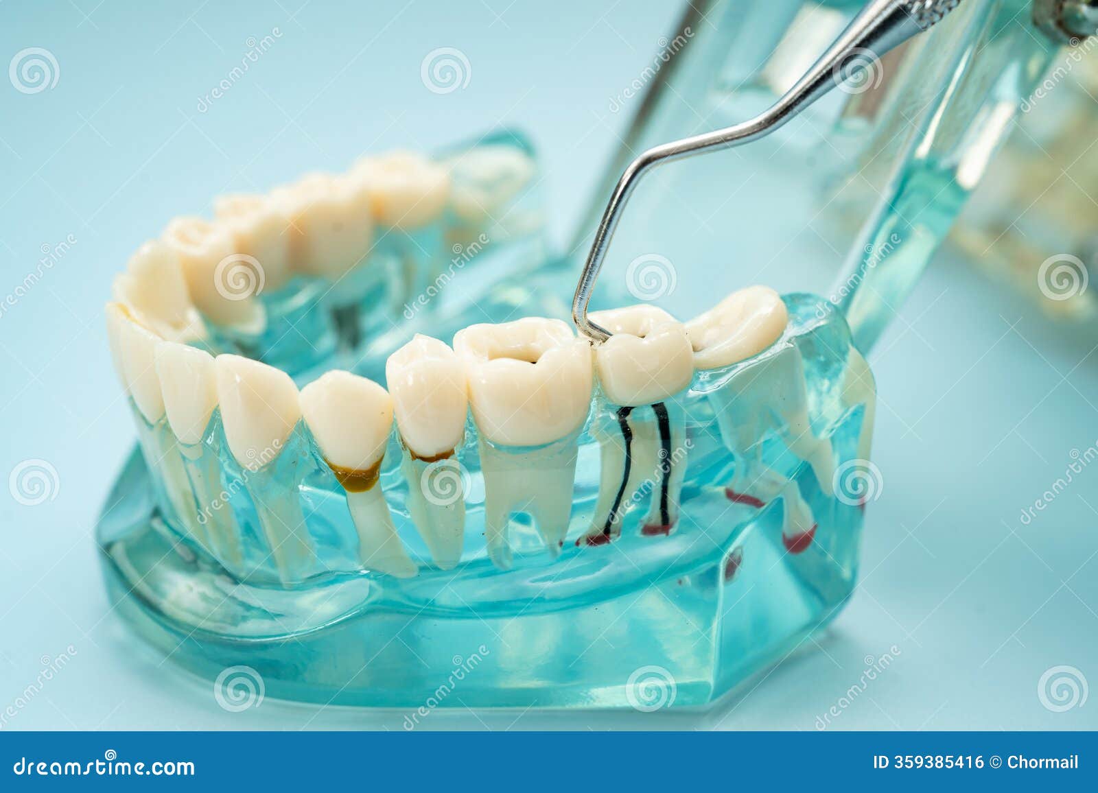 Dental Teeth Model with Dentist Tool for Dentistry Stock Photo - Image ...