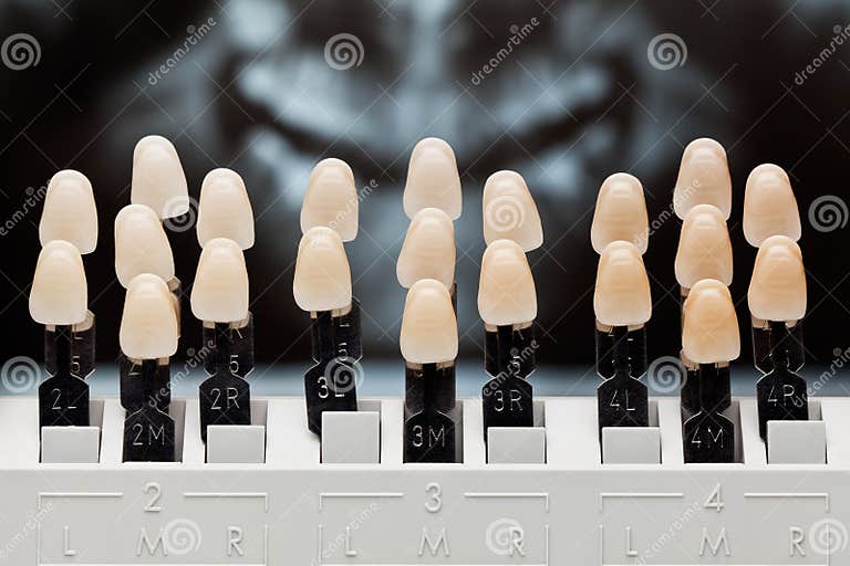 Dental teeth shades. stock image. Image of dentist, human - 20436935
