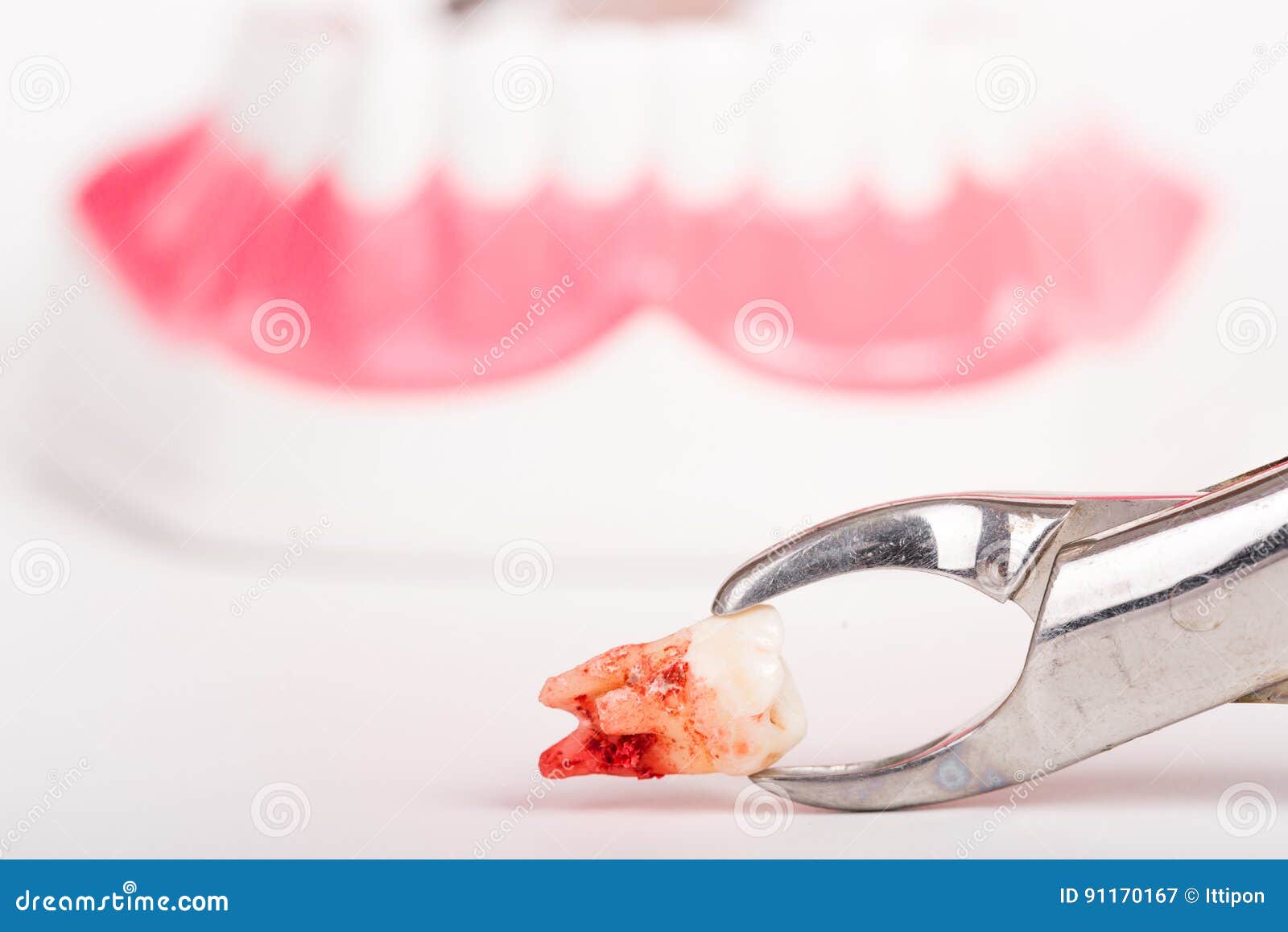Dental Tools and Remove Tooth at Clinic Isolated Stock Image - Image of ...