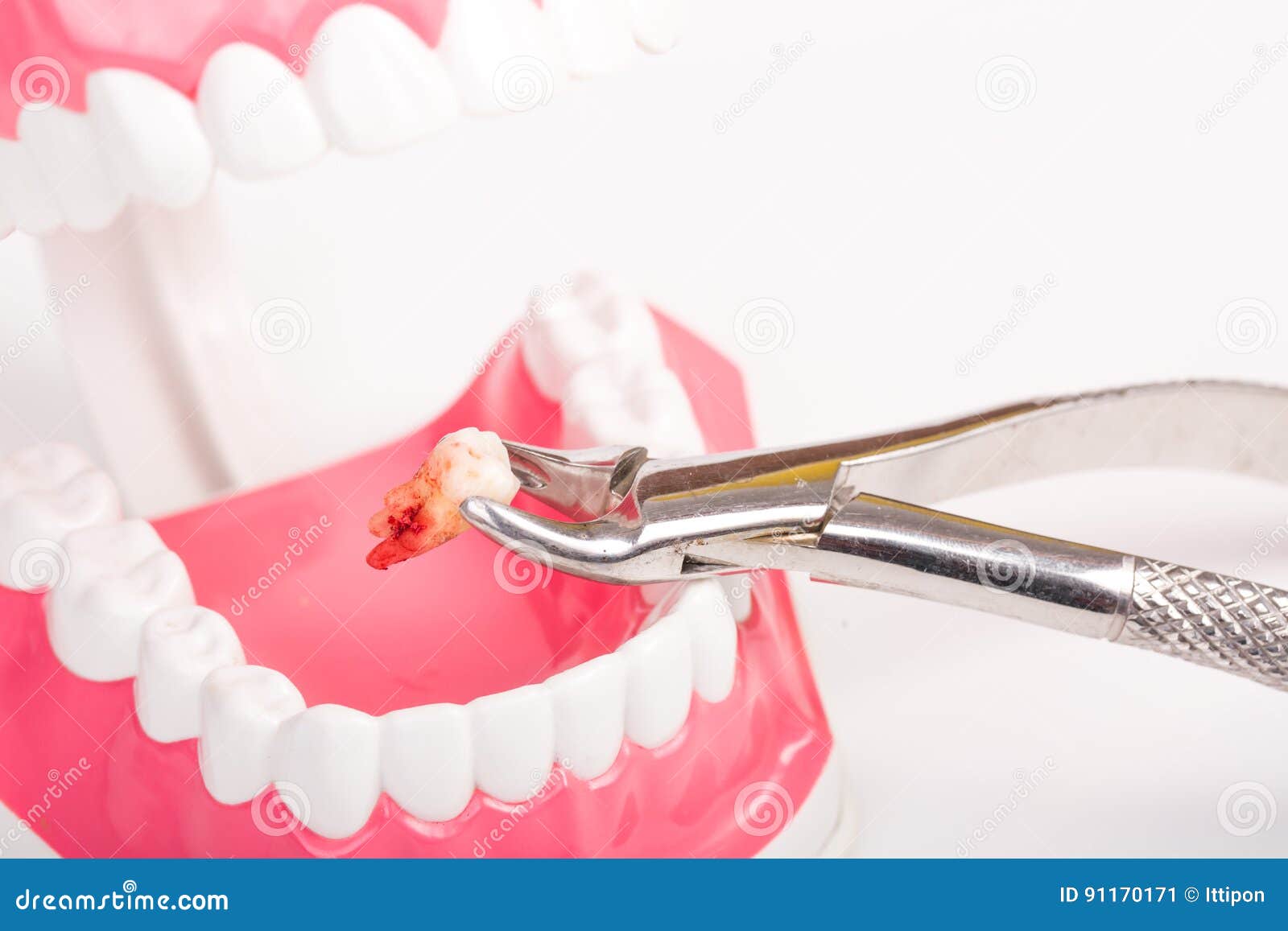 Dental Tools and Remove Tooth at Clinic Isolated Stock Image - Image of ...