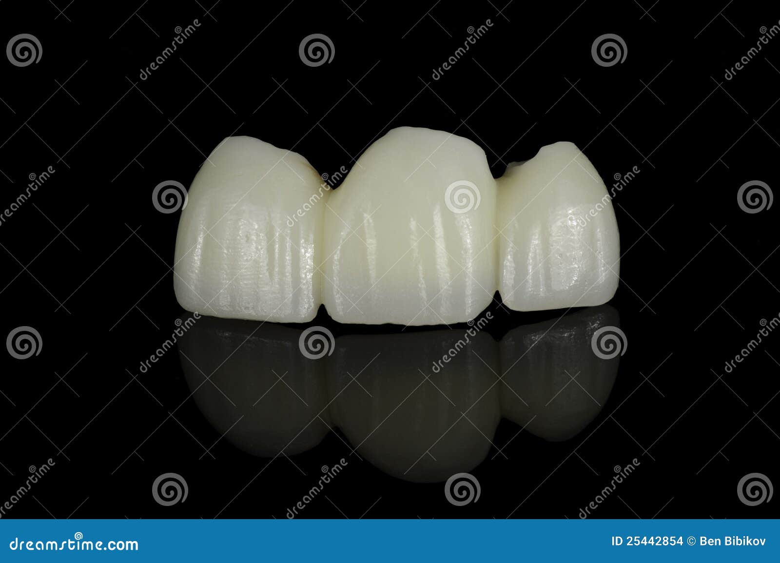 Dental Tooth Bridge stock photo. Image of reflective - 25442854
