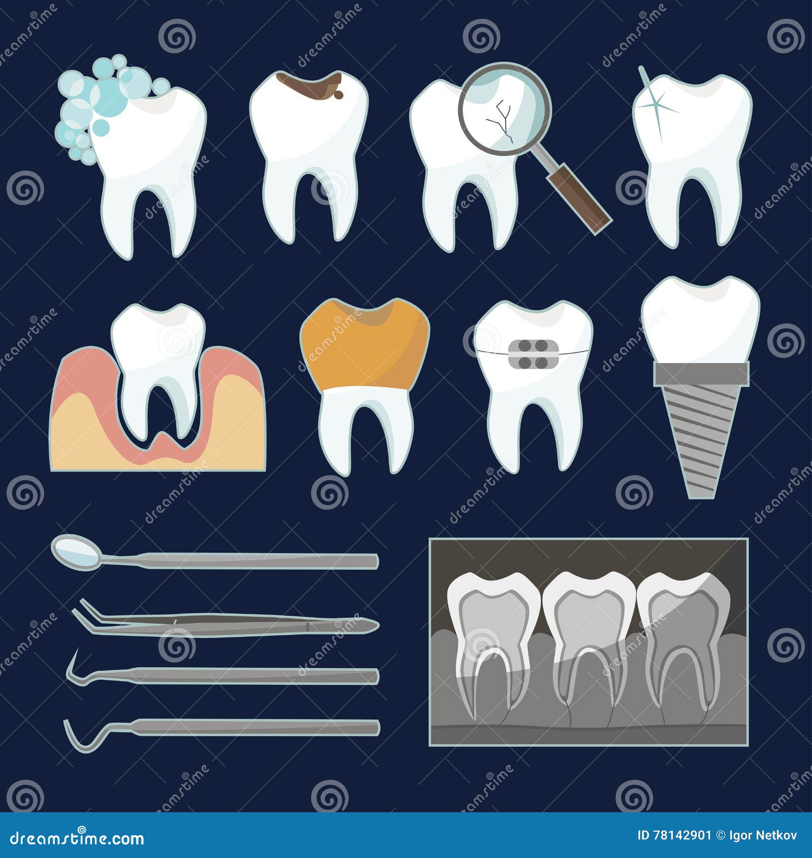 Tooth Icons, Caries And Treatment Symbols Cartoon Vector ...