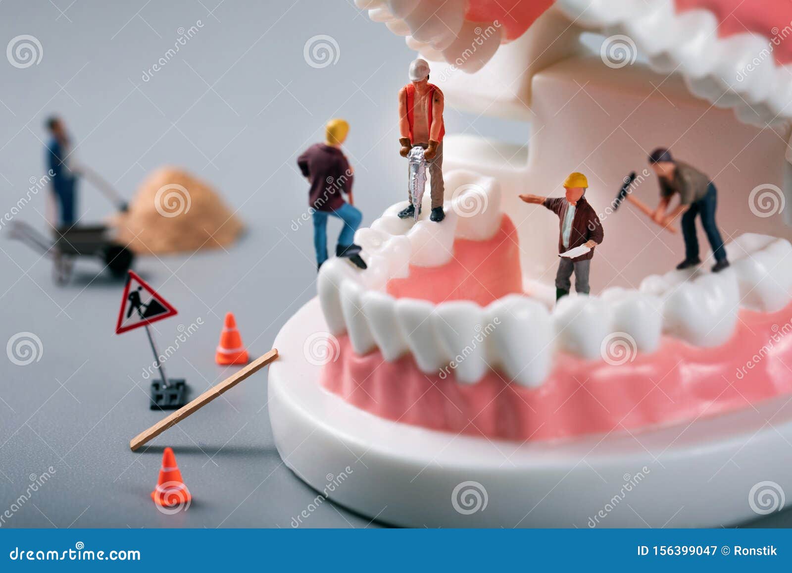 Tooth Model With Caries, Tooth Decay In Dentist`s Office. Healthy Teeth ...